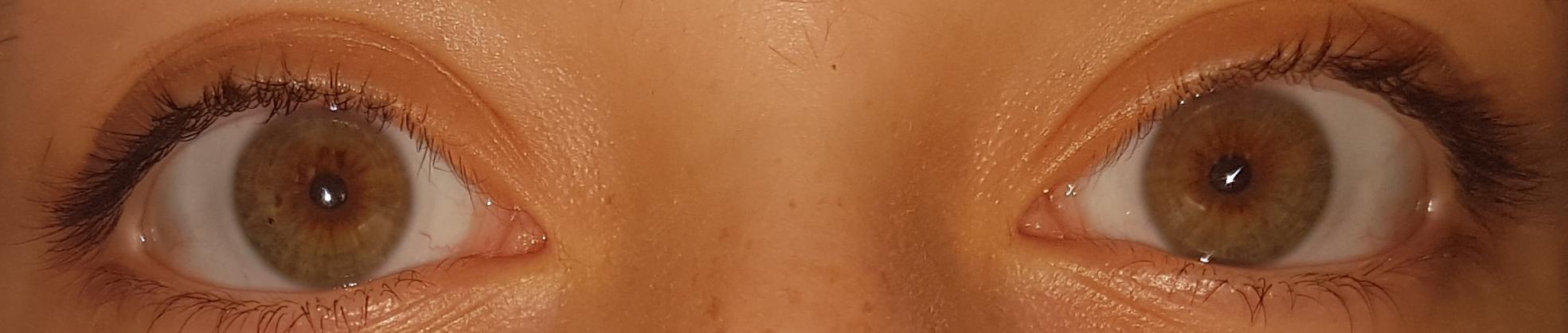 Sind das Hazel Eyes? Und ist das eine Zentrale Heterocromie? Welche ...
