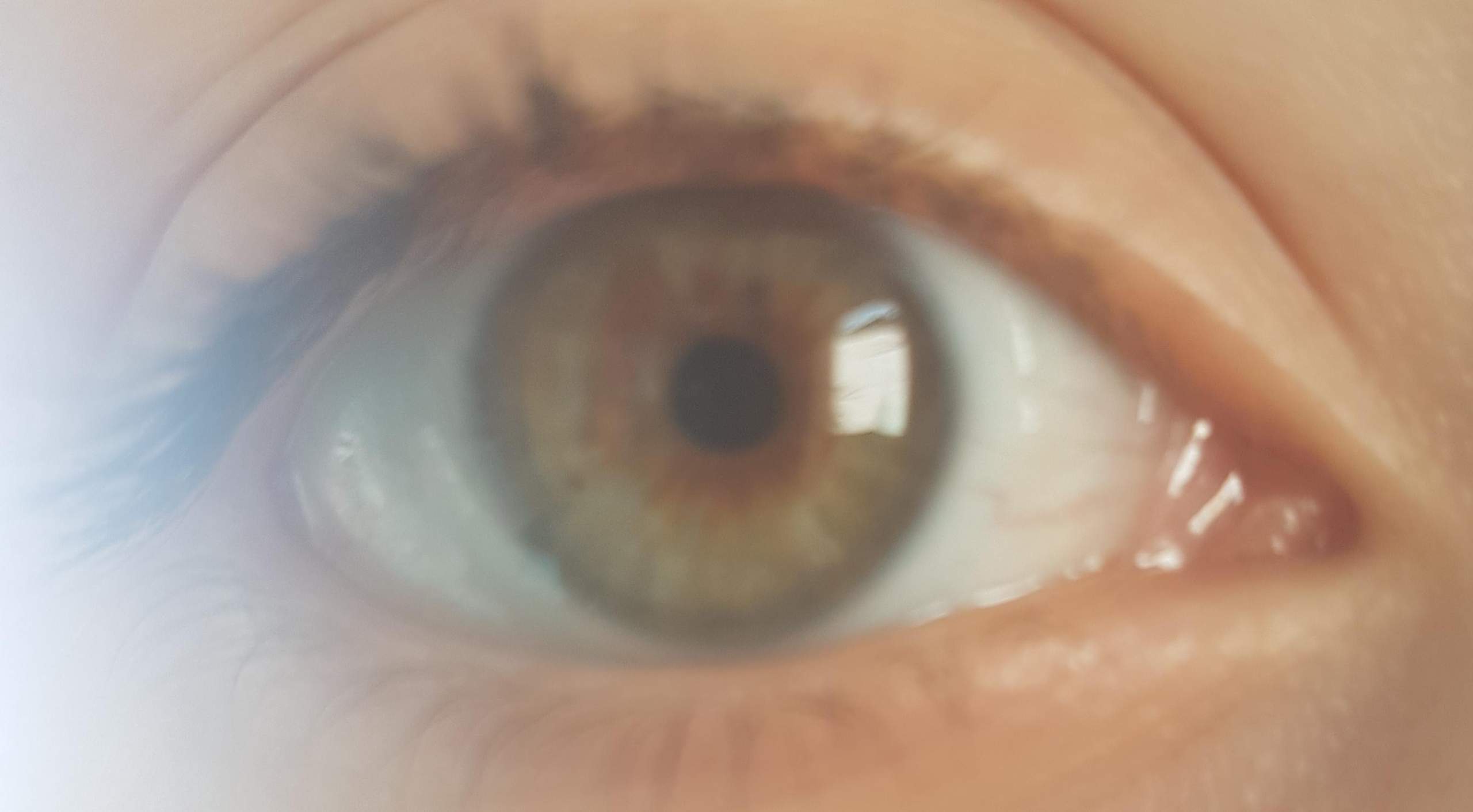 Sind das Hazel Eyes? Und ist das eine Zentrale Heterocromie? Welche ...