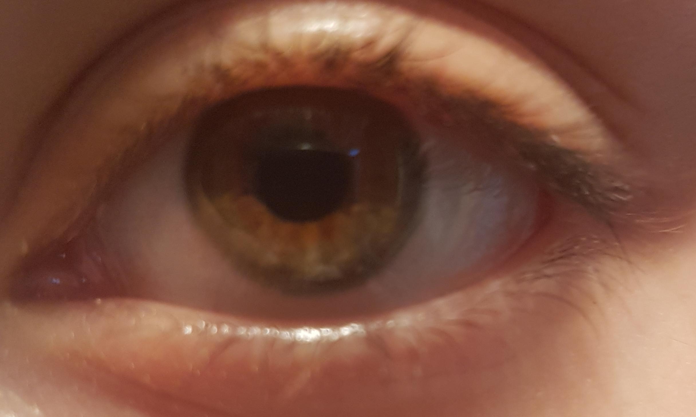 Sind das Hazel Eyes? Und ist das eine Zentrale Heterocromie? Welche ...