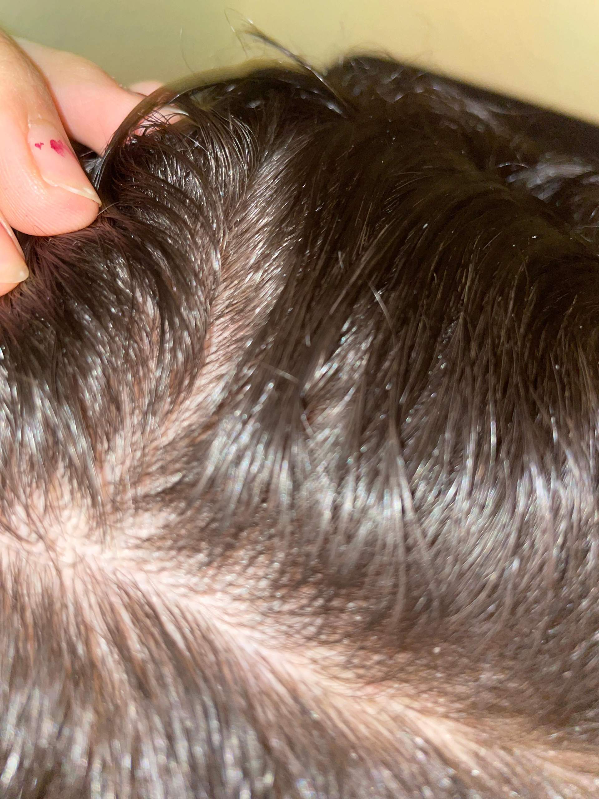 Sind das läuse? (Gesundheit, Haare)