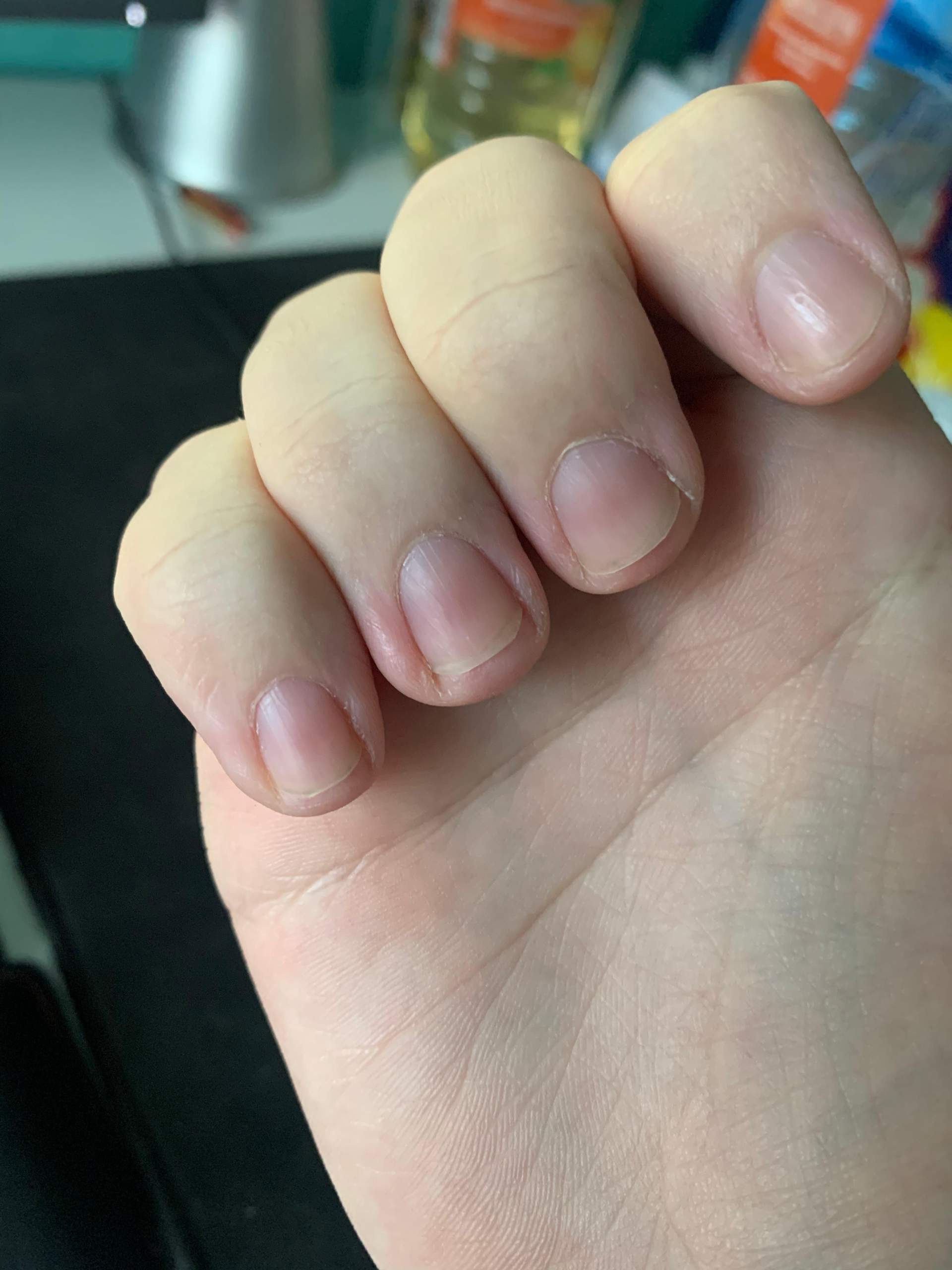 Sind das Vorboten einer zyanose? (Gesundheit und Medizin, Medizin)