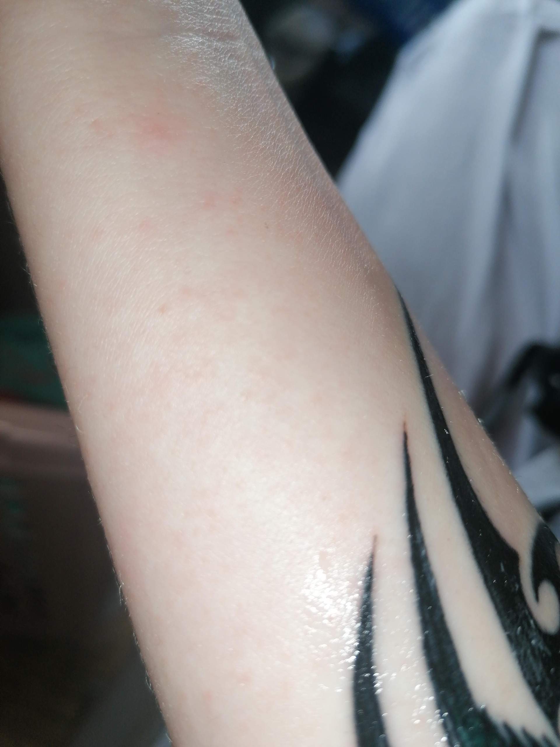 Pickel Unter Tattoo