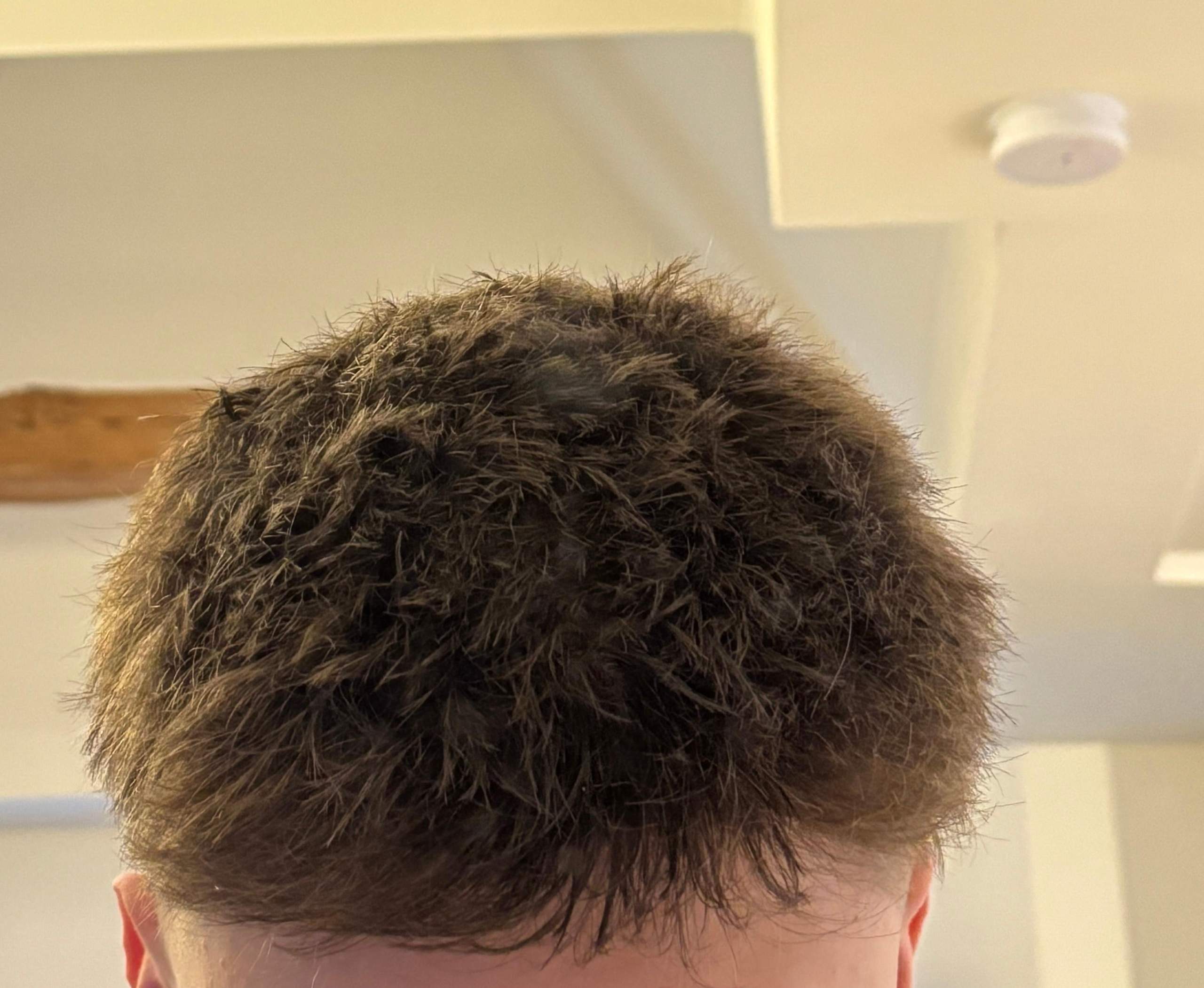 Sind meine Haare beschädigt / trocken, und wie kann ich es wieder ...