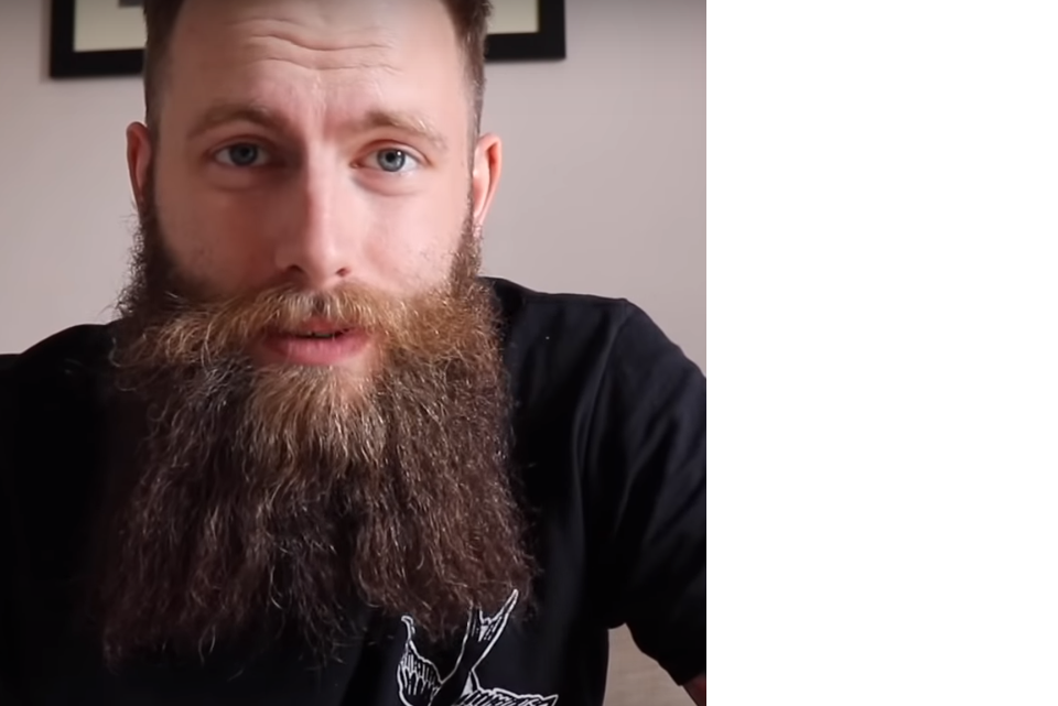 Steht mir ein längerer Vollbart? (Bartwuchs)