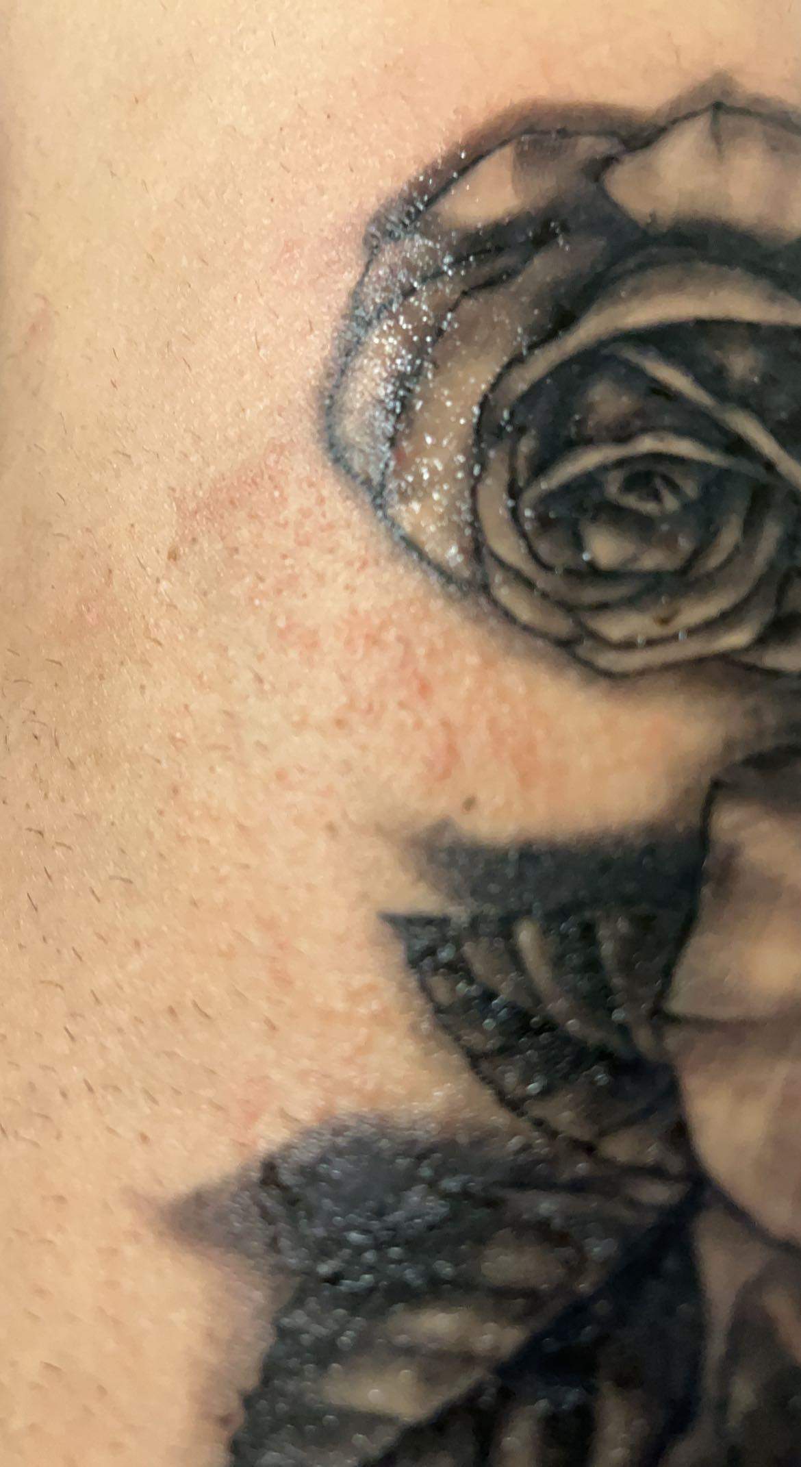 Tattoo Ausschlag? (Gesundheit und Medizin, Haut)
