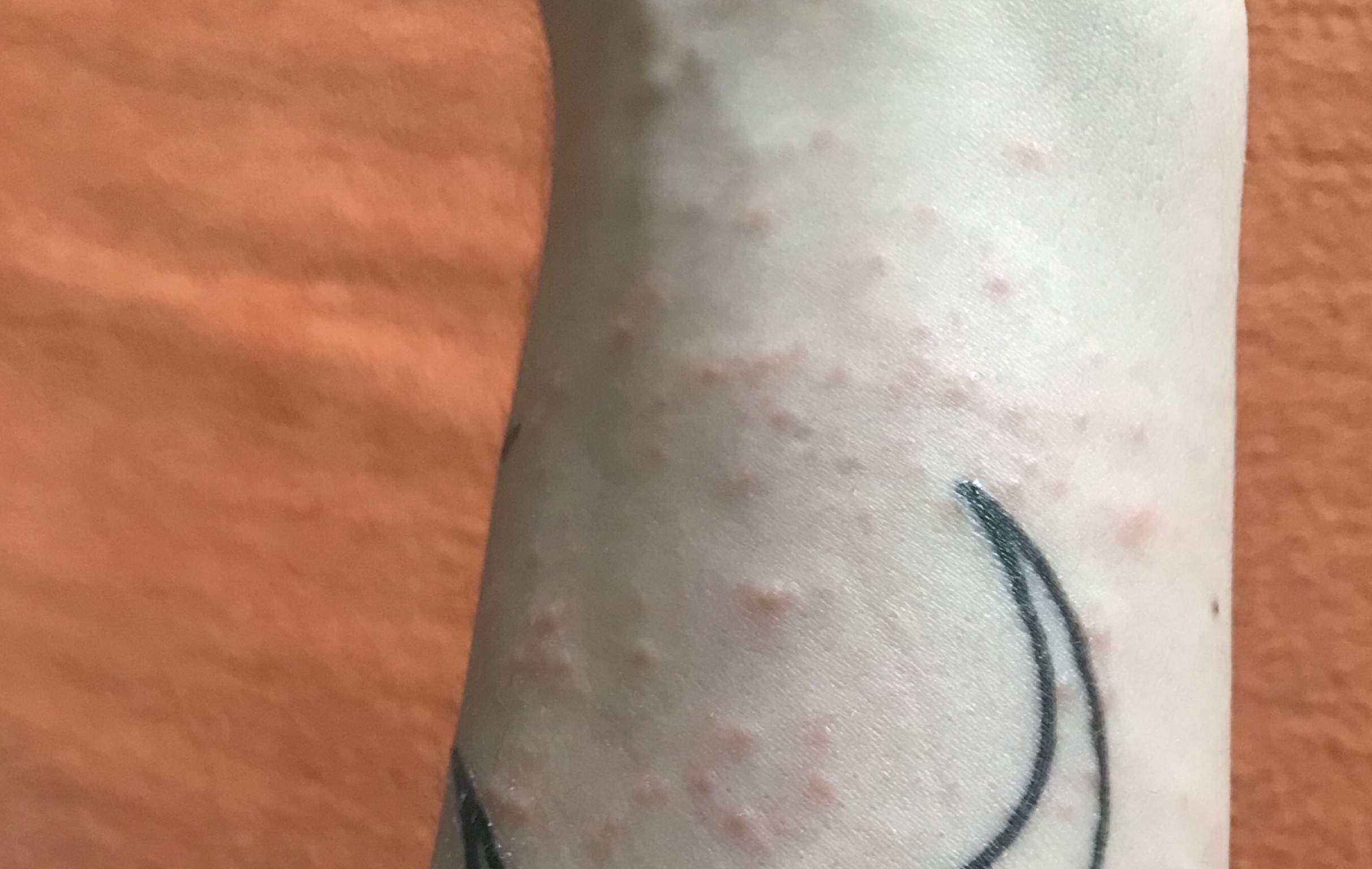 Ausschlag Auf Tattoos Wie Sie Ein Gutes Tattoo Studio Erkennen
