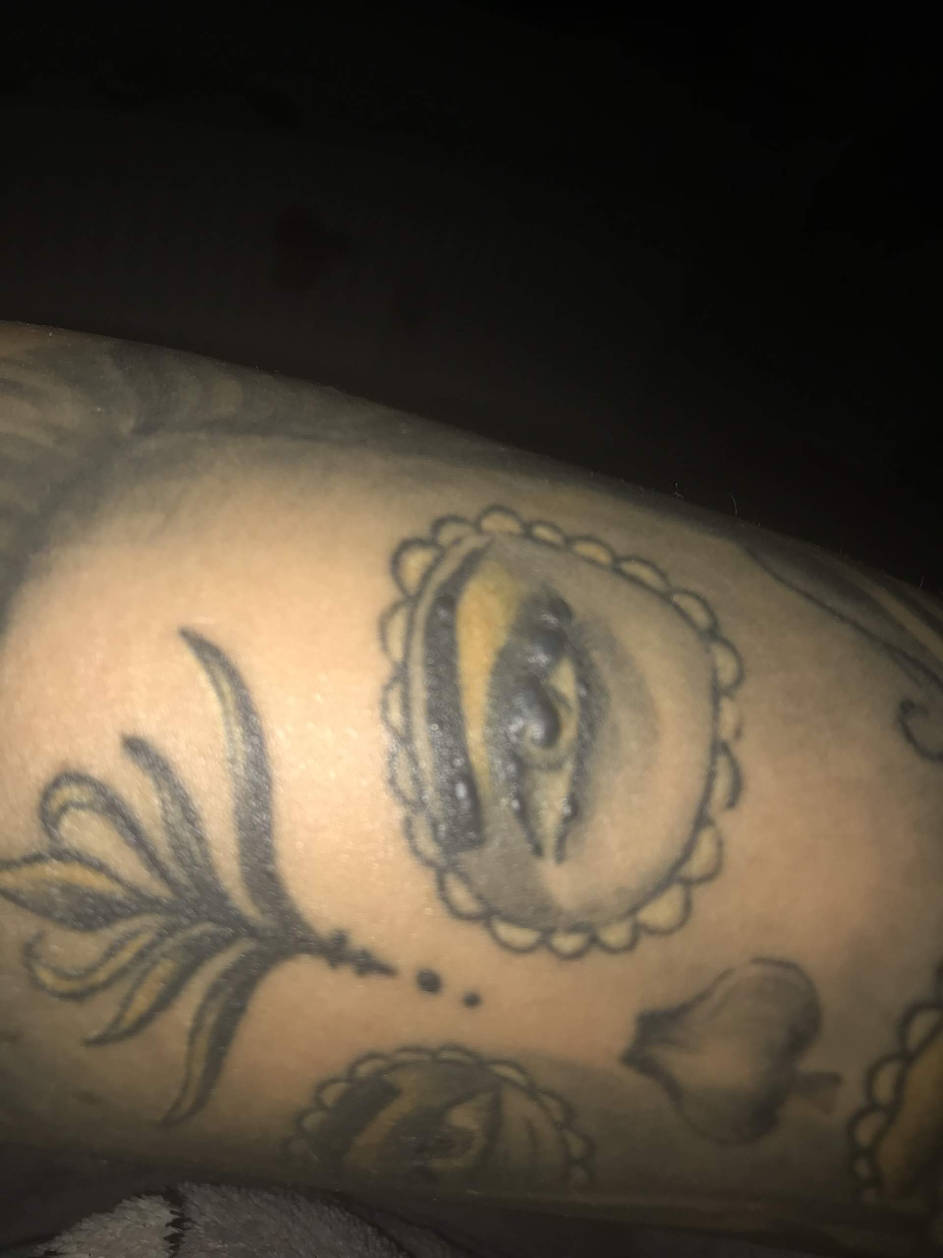 Tattoo beulen? pickel? (Beule)