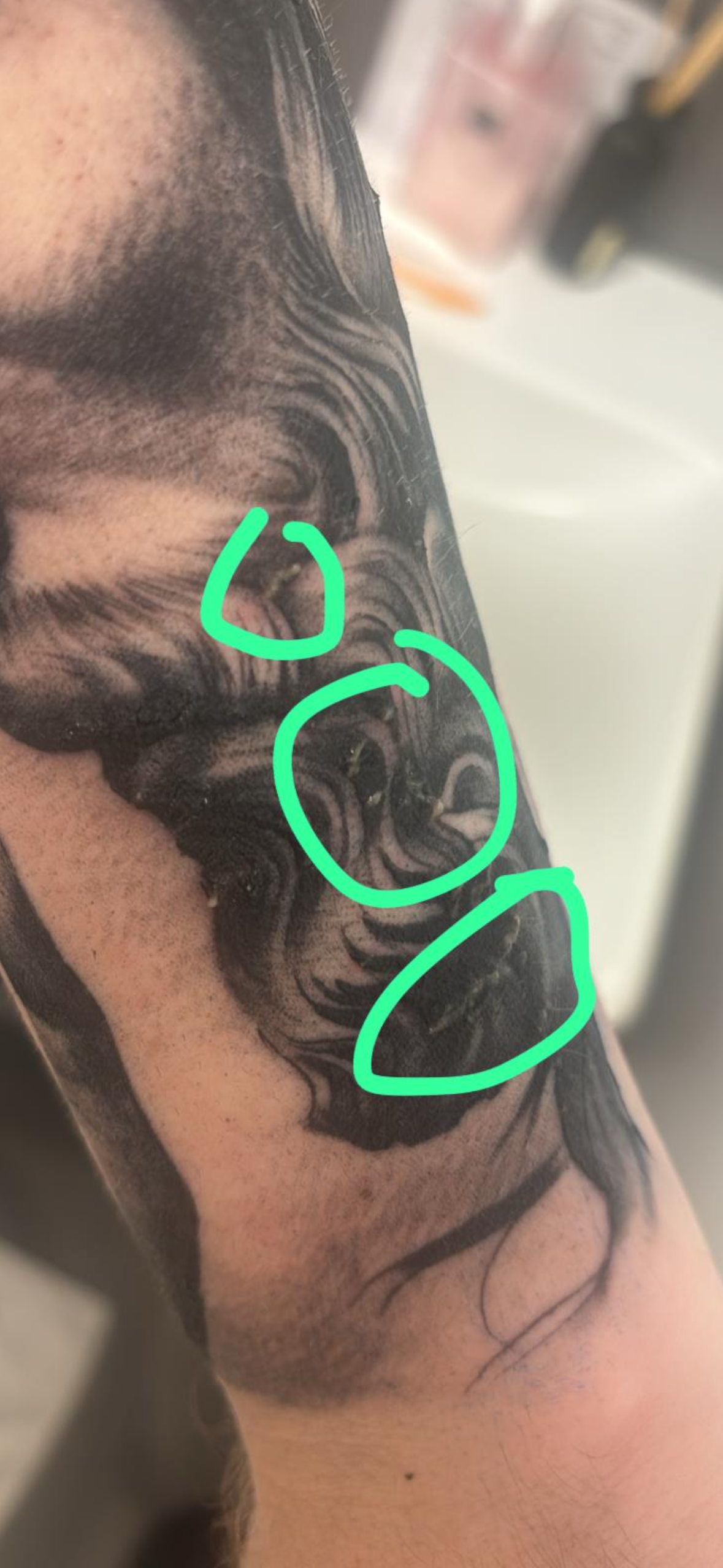 Tattoo Eiter? (Tattoopflege)