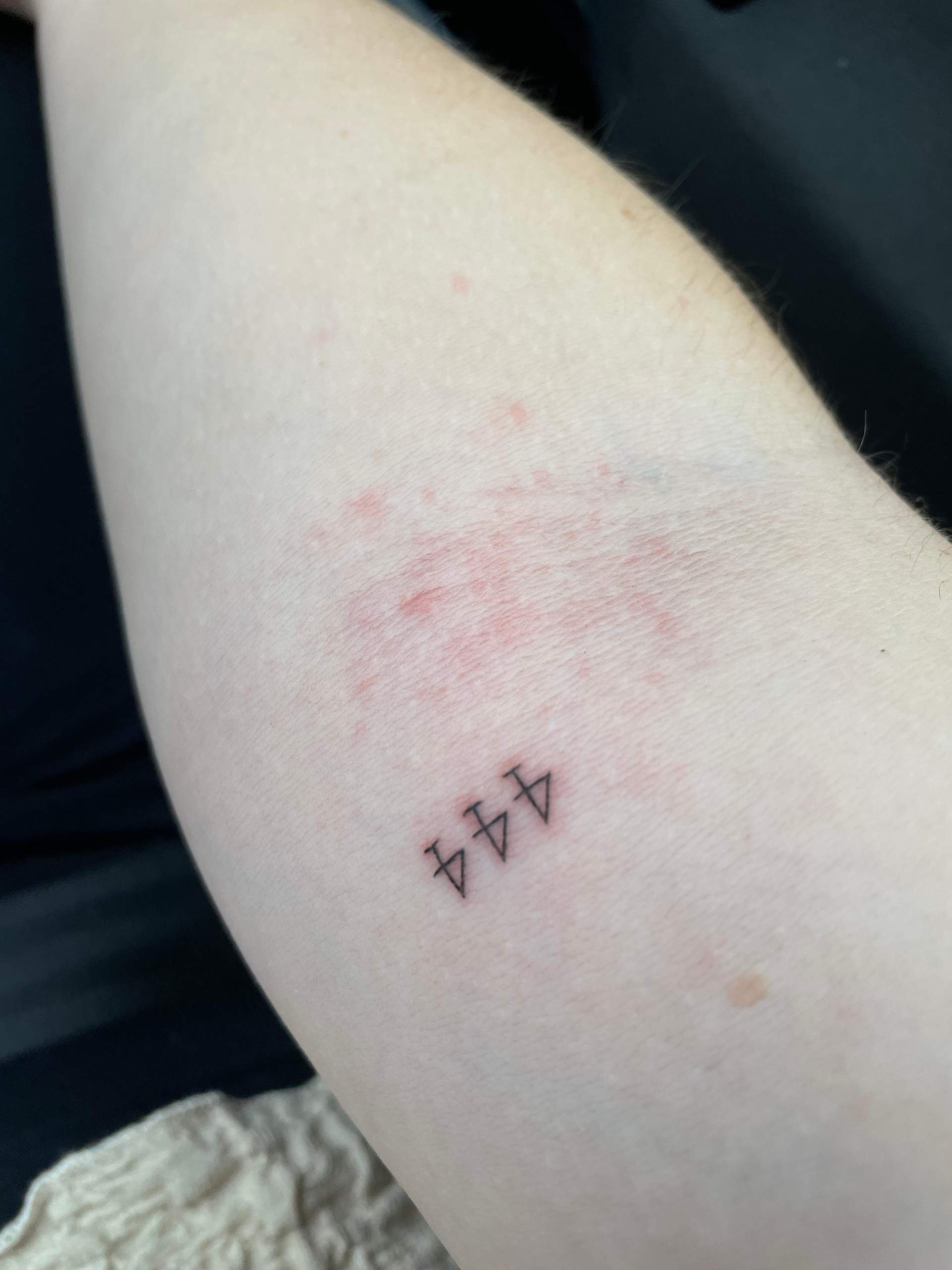 Juckreiz Bei Neuem Tattoos 3 Dinge, Die Ihr Niemals Mit Einem Neuen