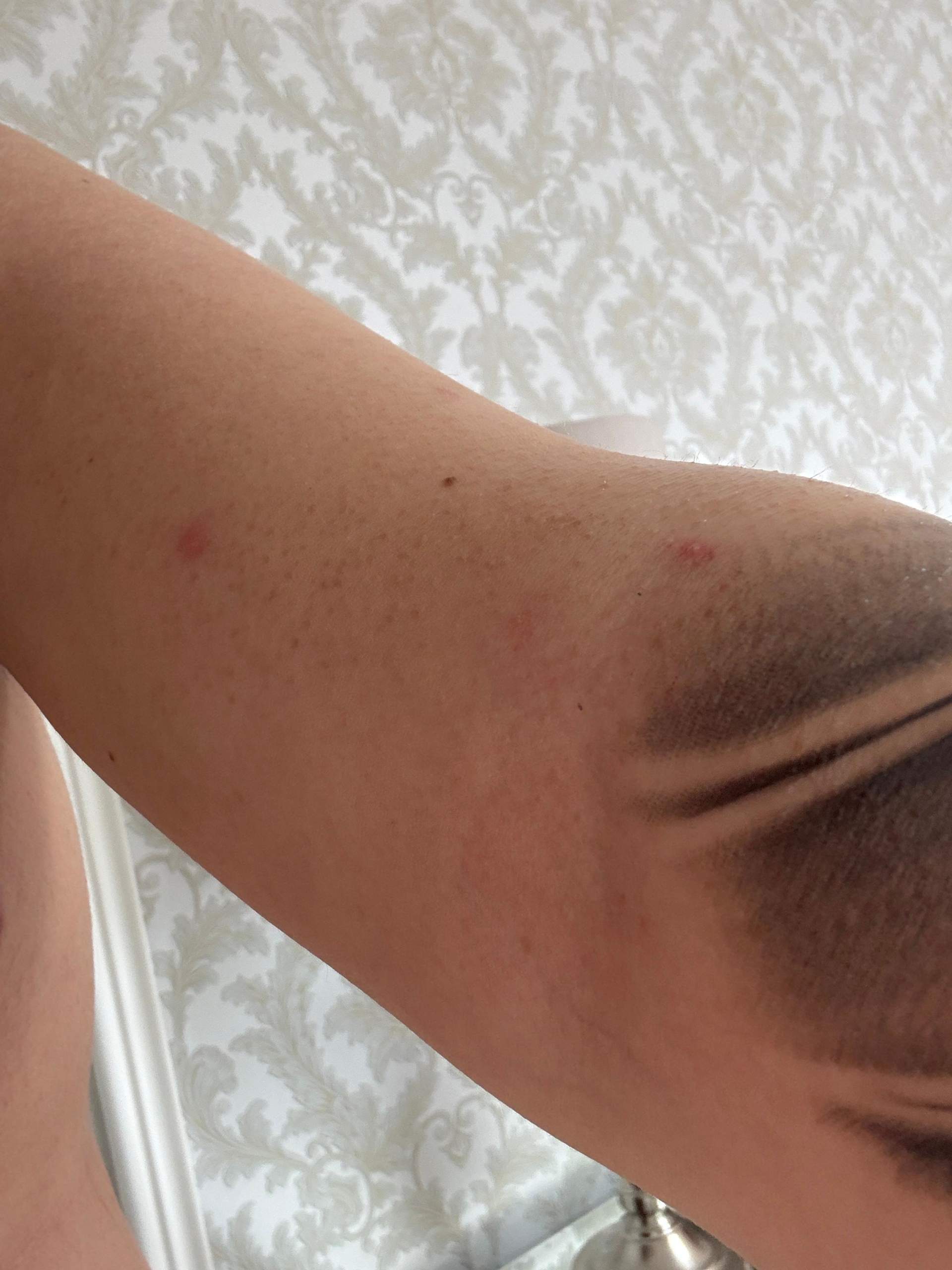 Pickel Unter Tattoo