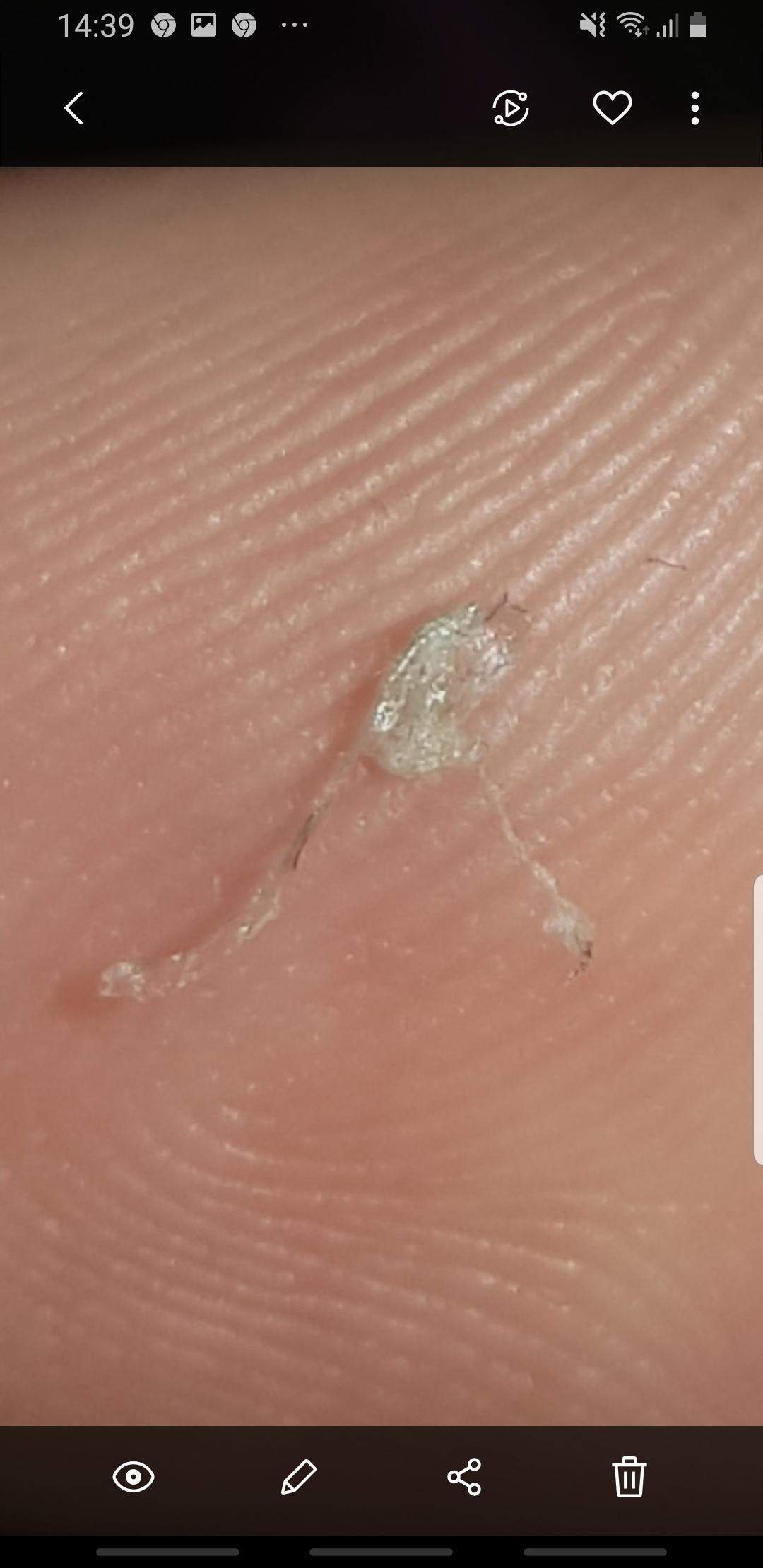 Tipps gegen ständig eiter in der Nase? (Gesundheit und Medizin, Gesundheit)