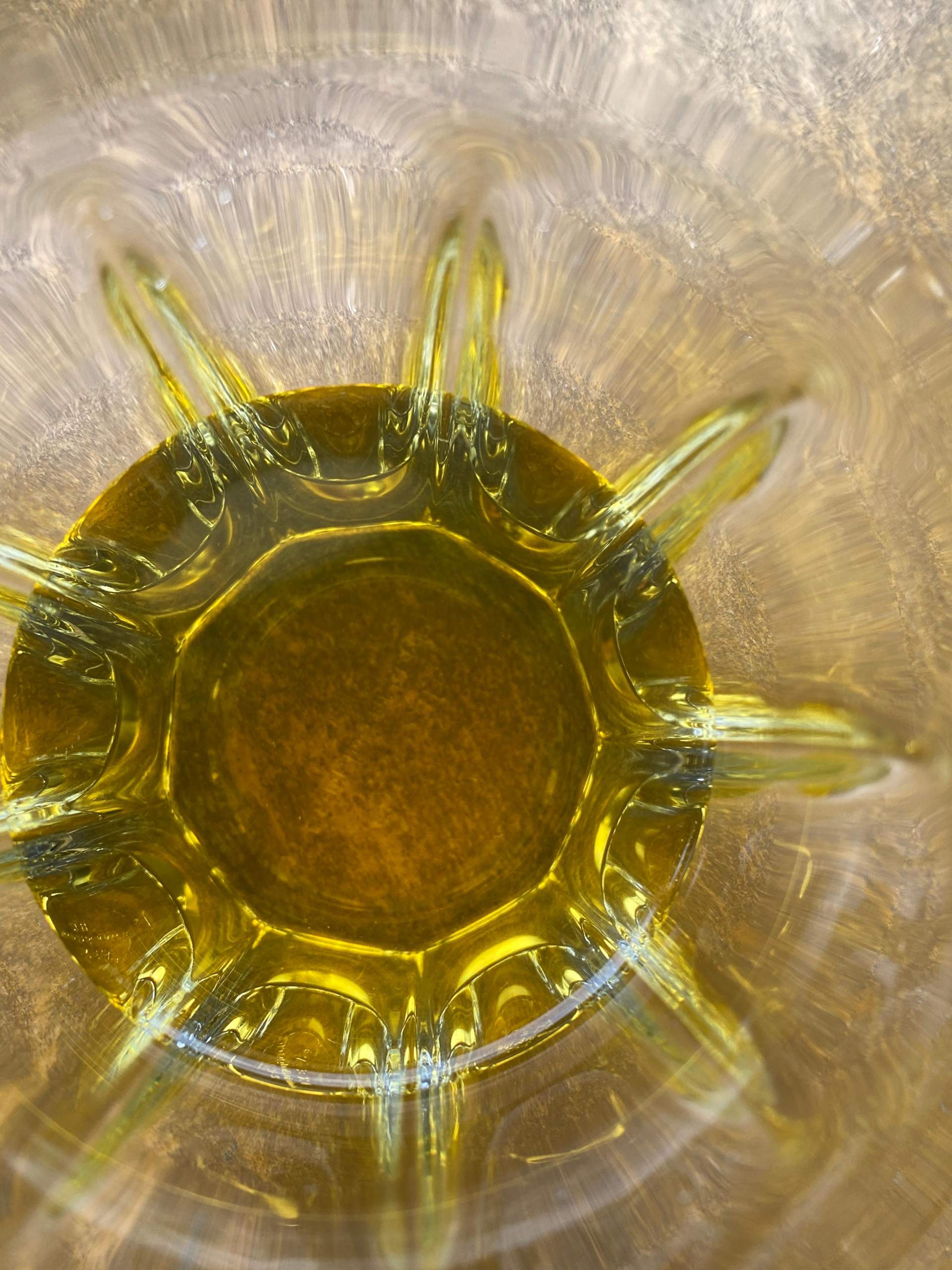 Urin braun? (Urinprobe)