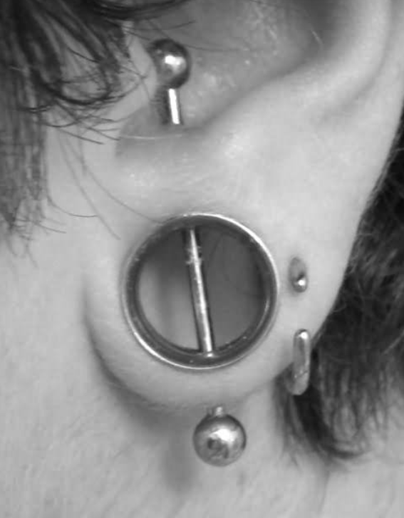 Vertical Transverse Lobe? (Piercing, Ohrloch, Piercingstudio)
