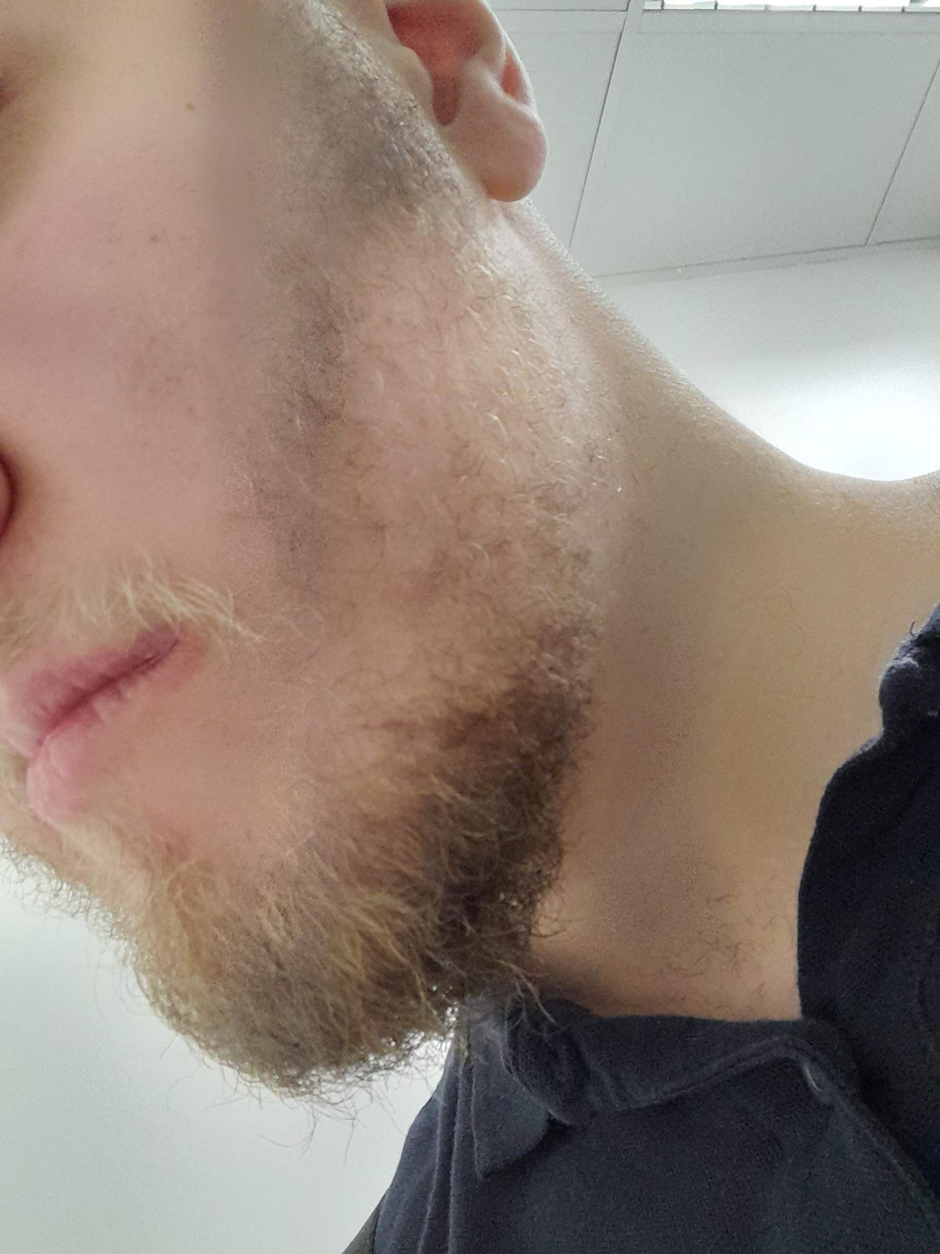 Vollbart wachsen lassen was zum Barber sagen? (Männer, Bartwuchs)