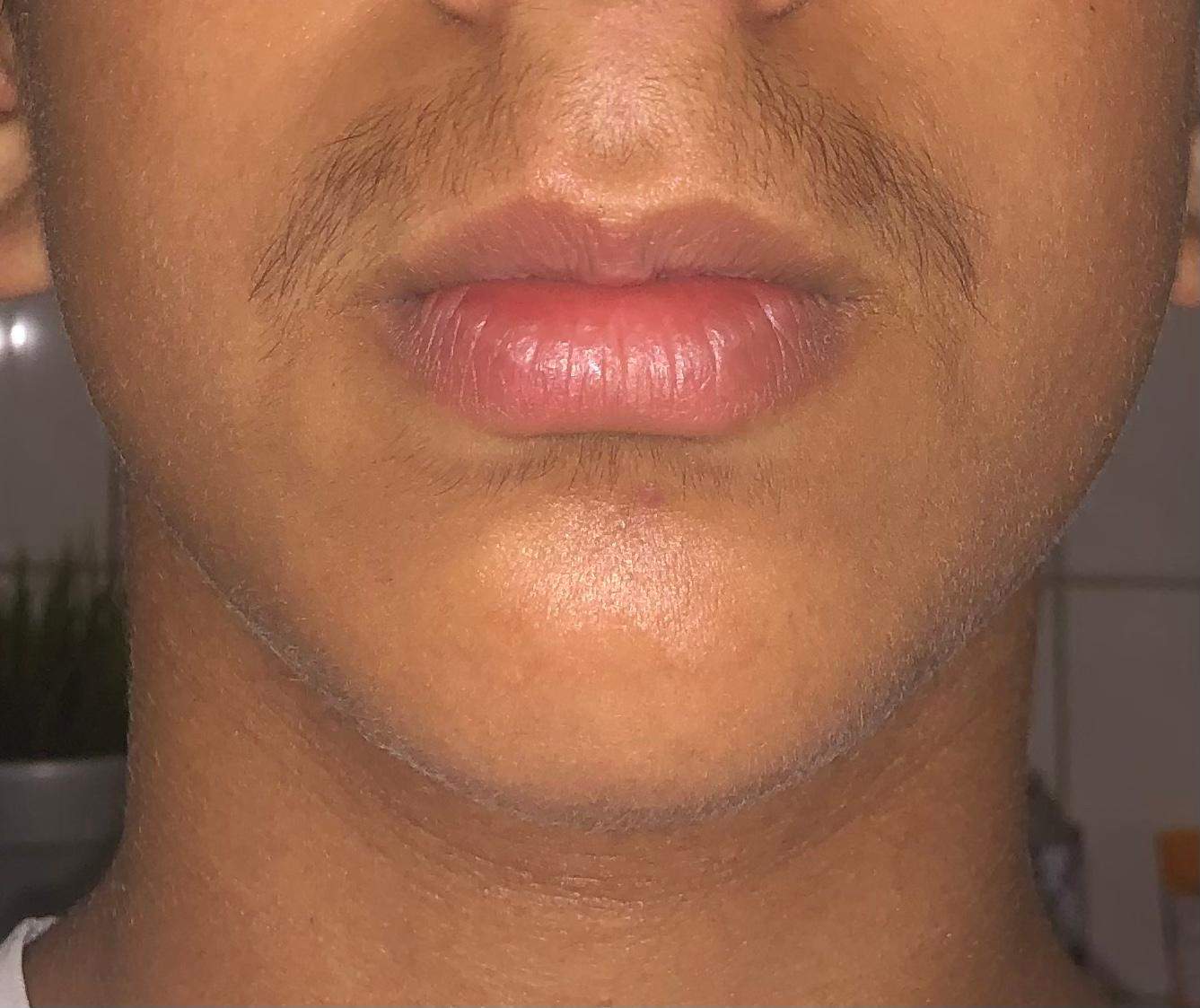 Wann wird aus einem bartflaum richtige Barthaare? (Pubertät, Pubertät ...