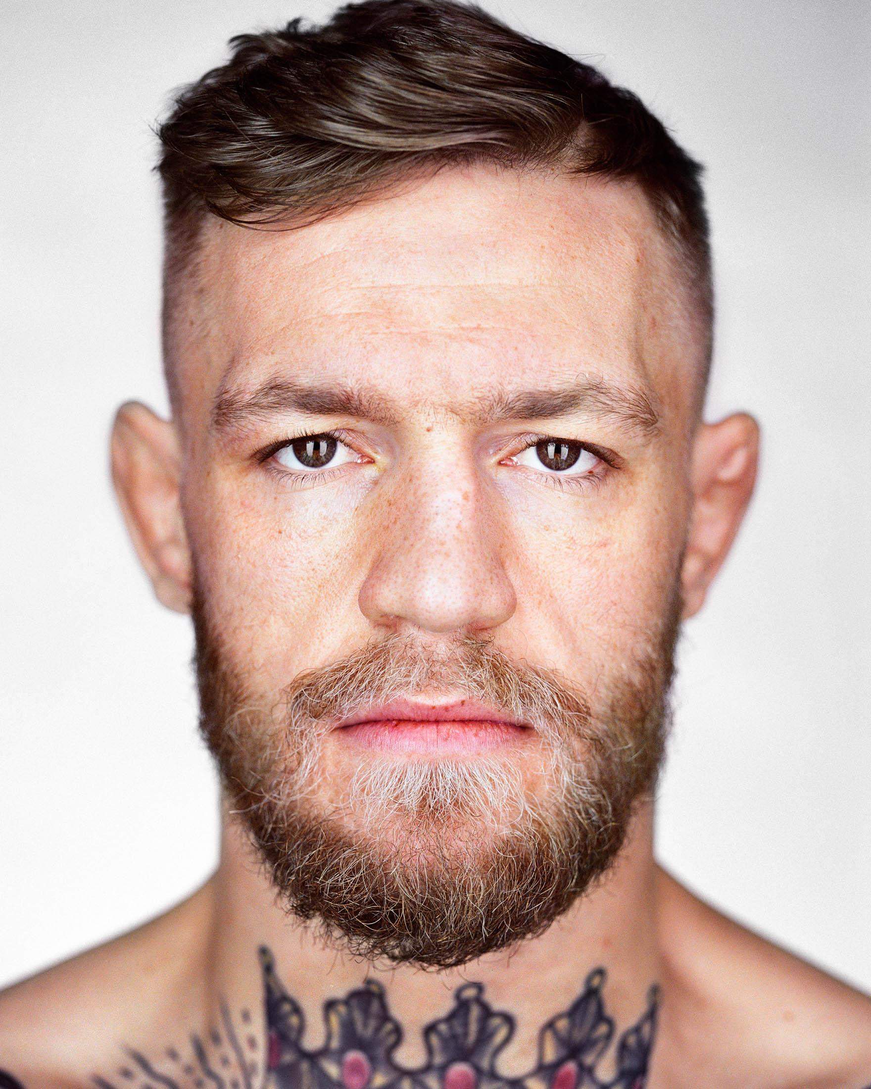 Warum sieht Conor McGregors Gesicht so anders aus? (MMA, UFC)