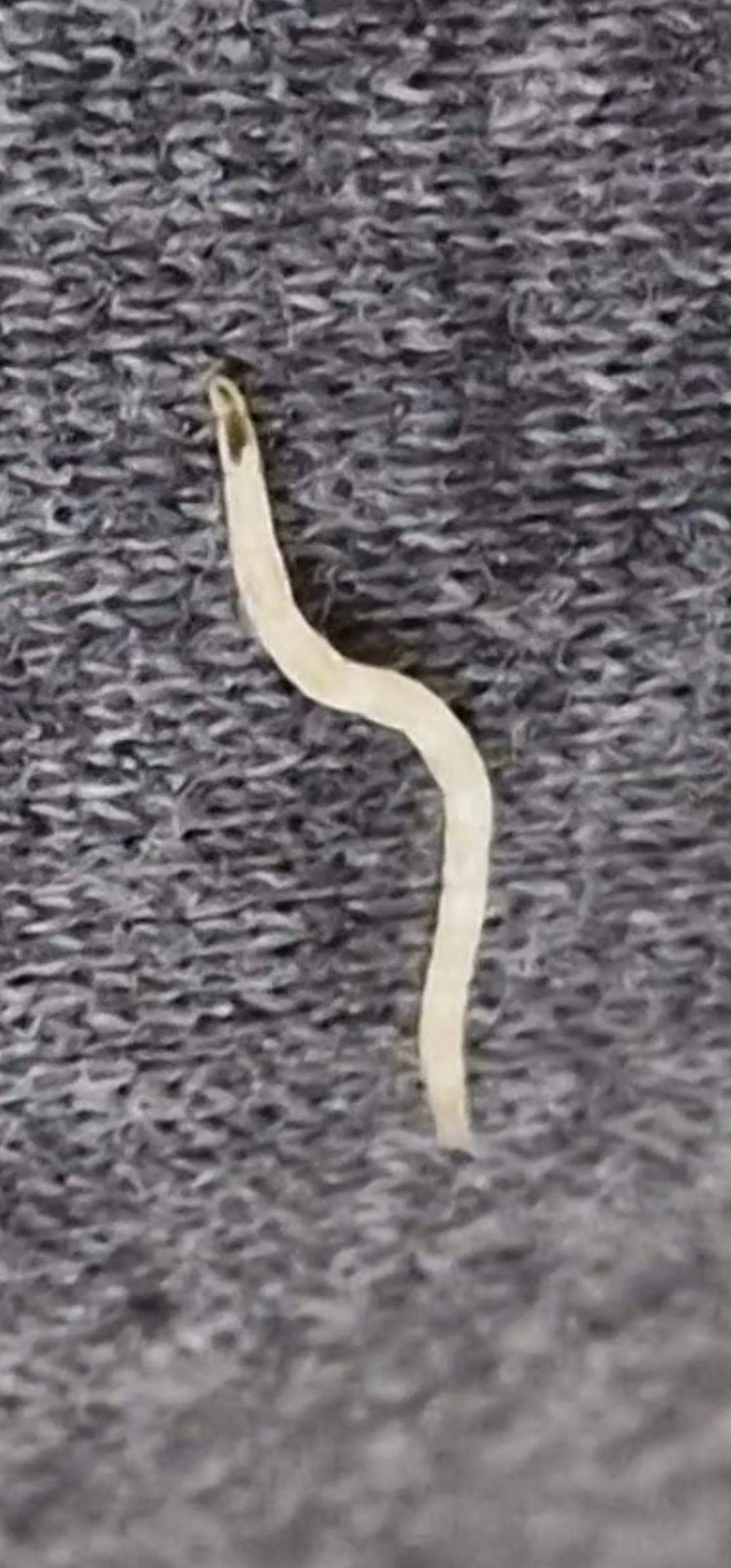 Was für eine made/wurm? (Insekten, Würmer, Parasiten)