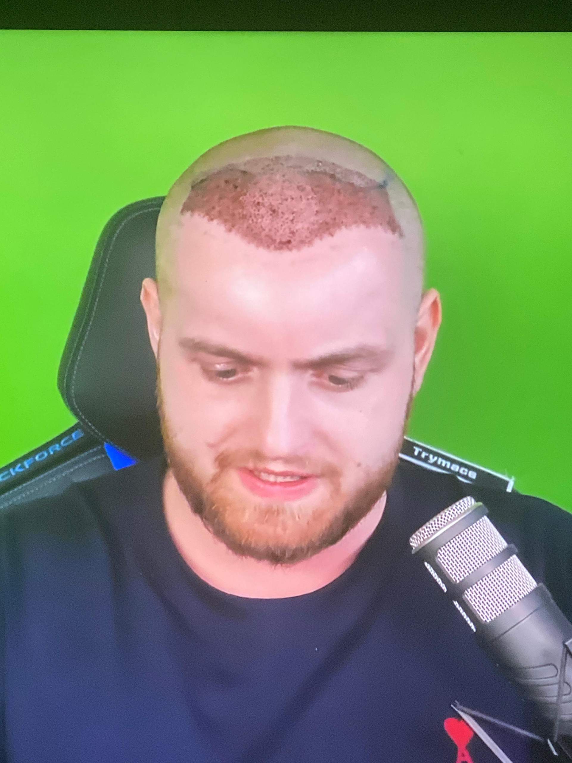 Was hat Trymacs da am kopf? (Twitch)