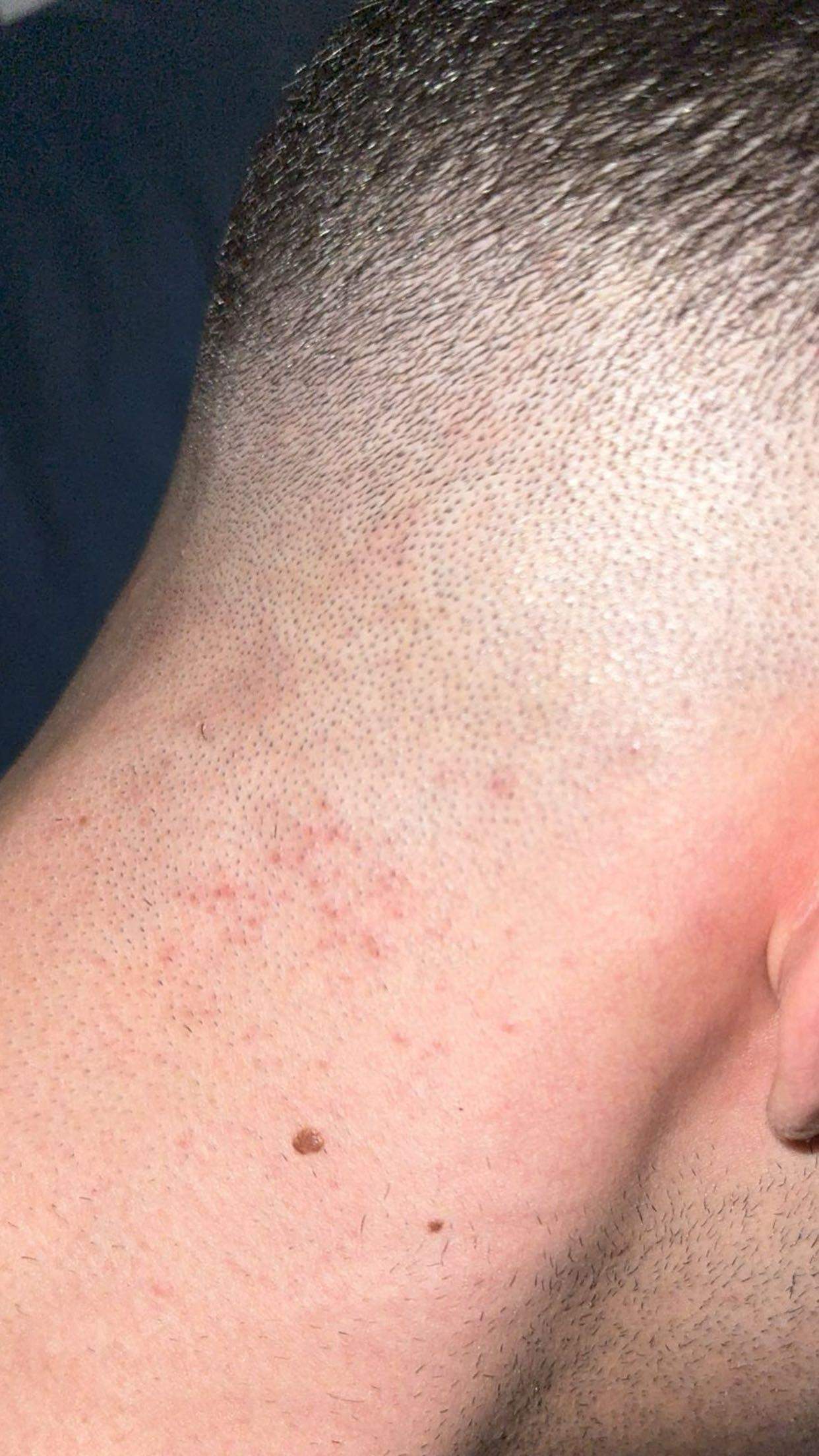 Was ist das auf mein Hinterkopf (war vorher beim friseur)? (Haarpflege ...