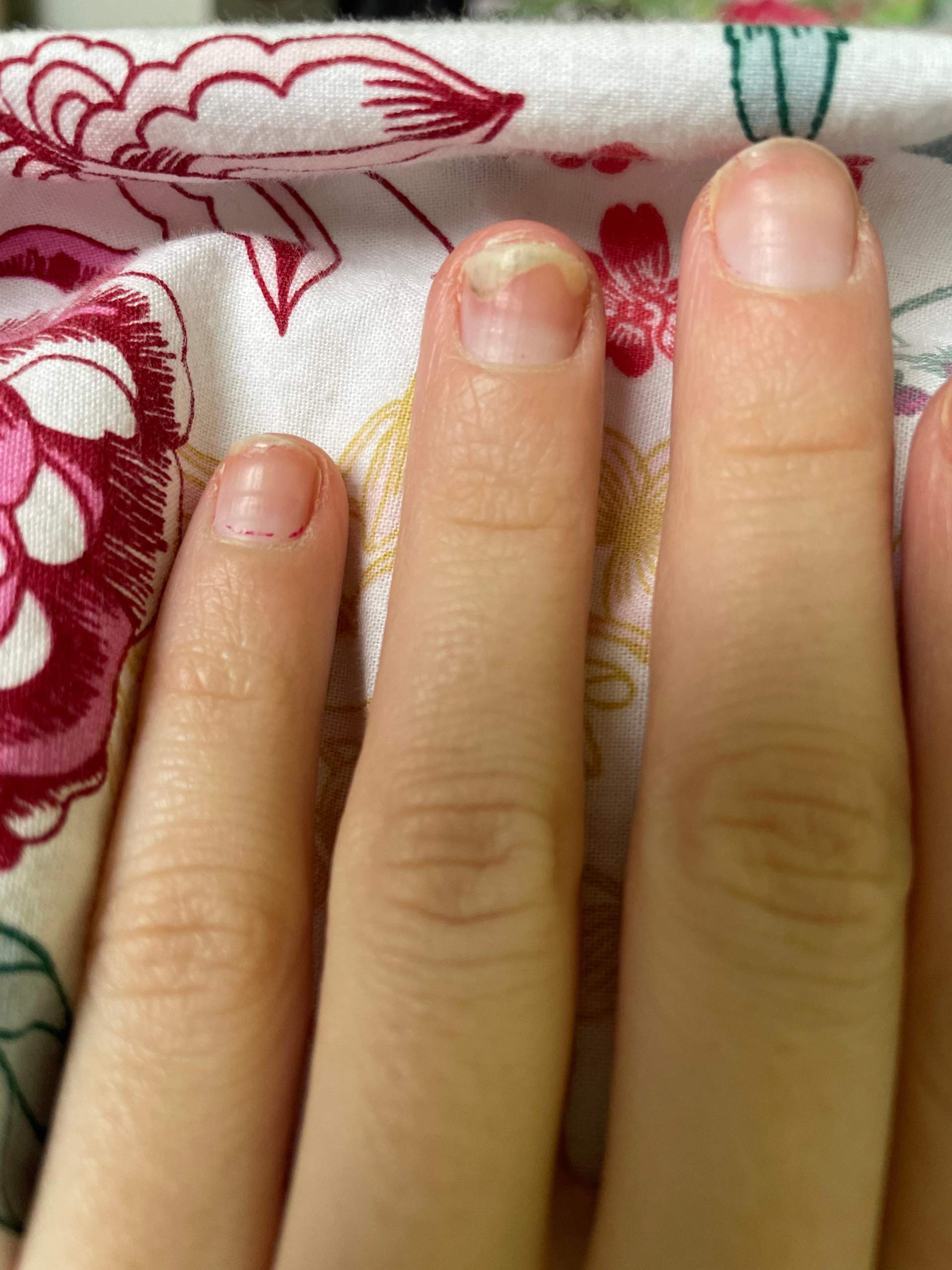 Was Ist Das Auf Meinen Fingernägeln Nägel Fingernägel Gelnägel