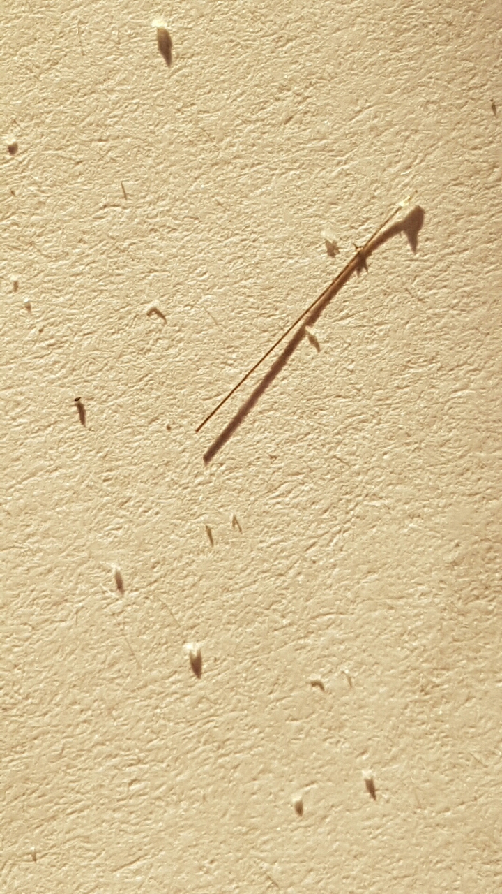 Was ist das? Läuse? (Haare)