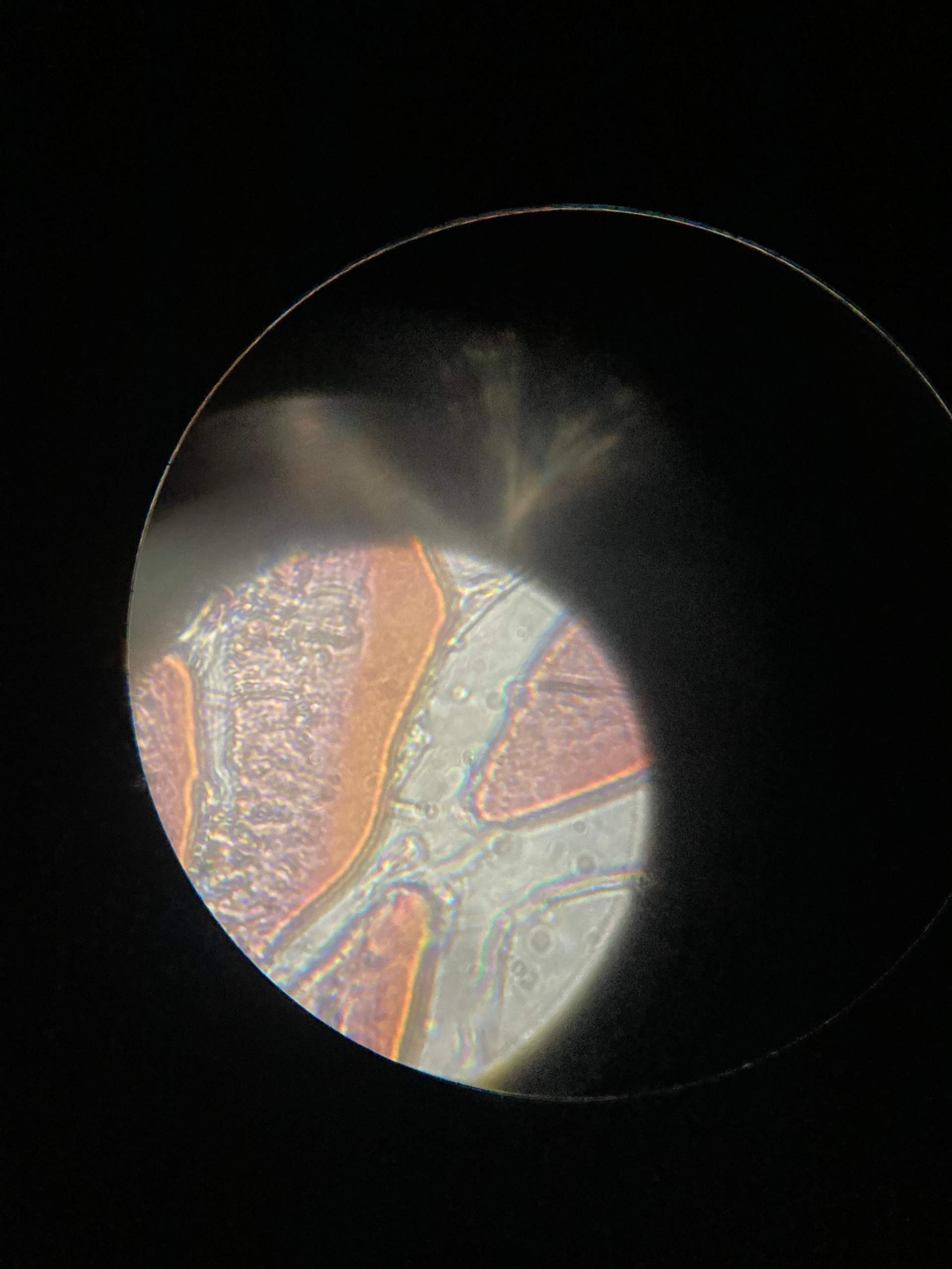 Was ist das (Mikroskop)? (Muskeln, Muskelaufbau, Insekten)