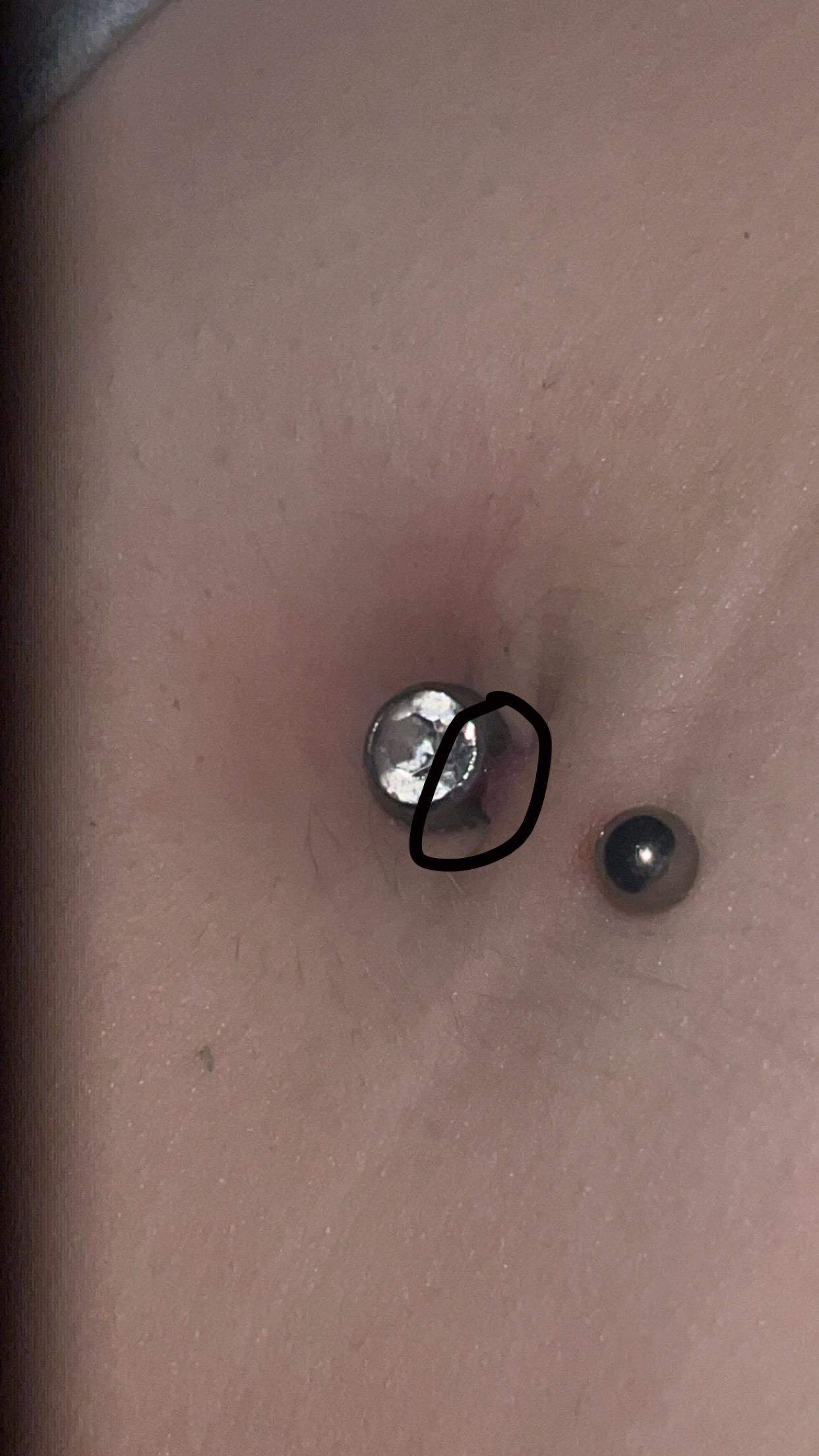 Was ist diese Haut, die sich über meinem Piercing bildet? (Pflege ...