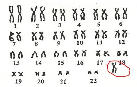 was sind das für mutationen (siehe bilder) (Biologie, Mutation)