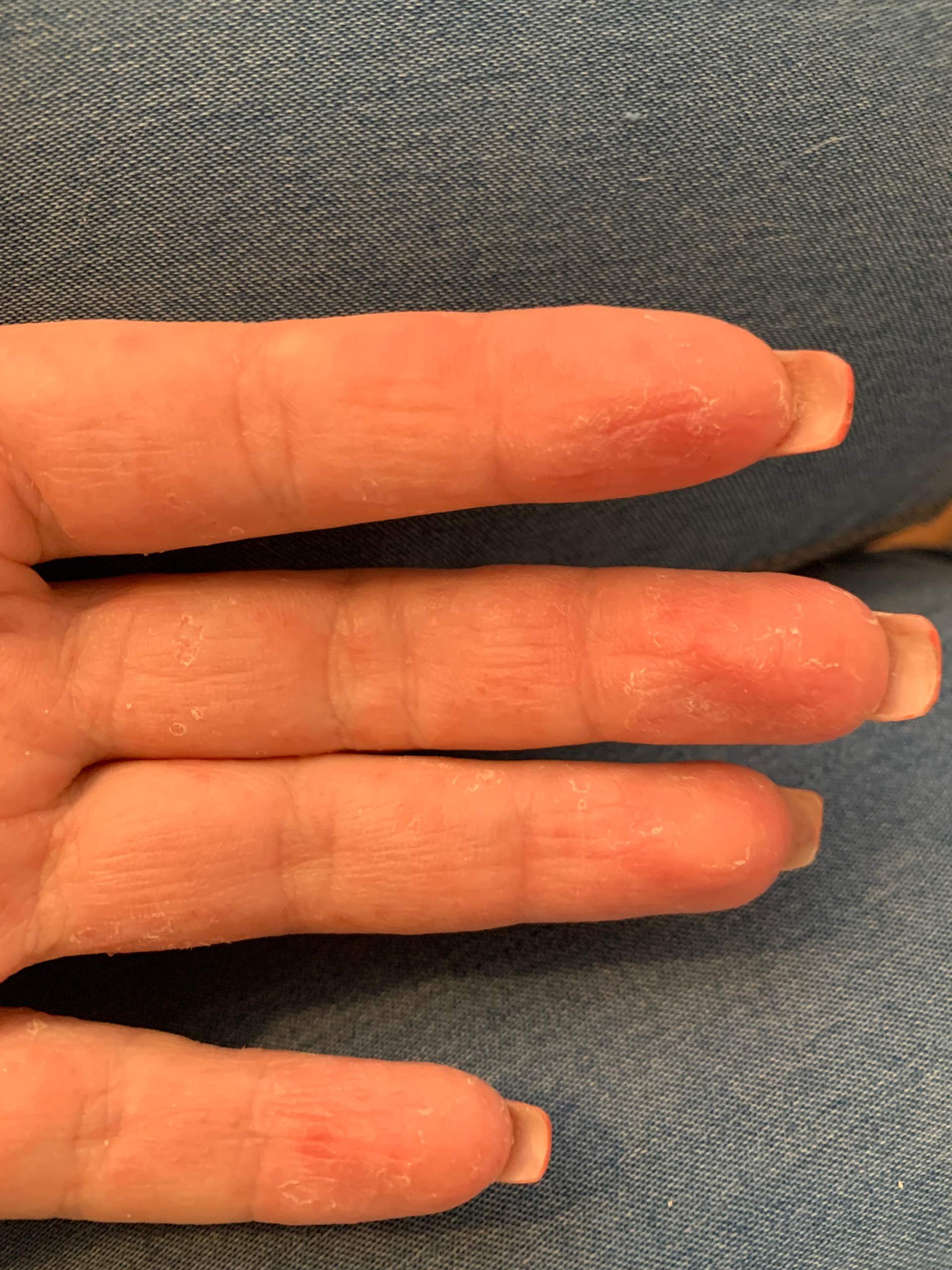 Was stimmt nicht mit meinen Fingern (Haut, Organe, Pilz ...