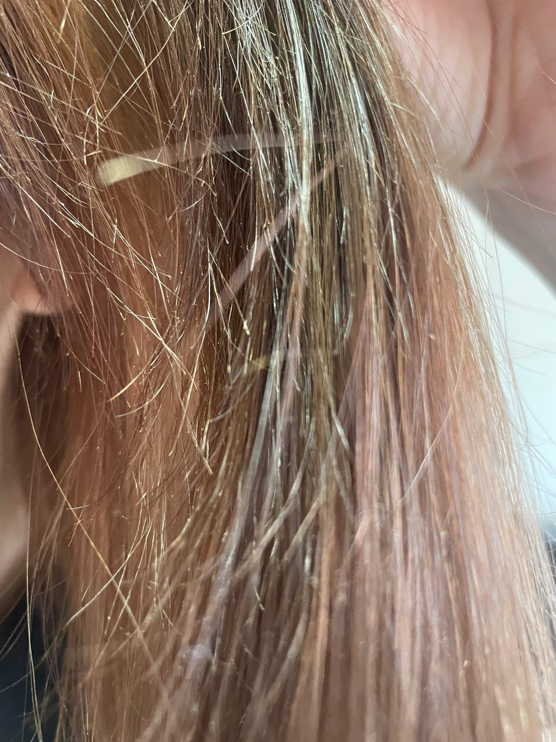 Was tun gegen Spliss, der schon bis oben an den Haaren ist? (Haare ...