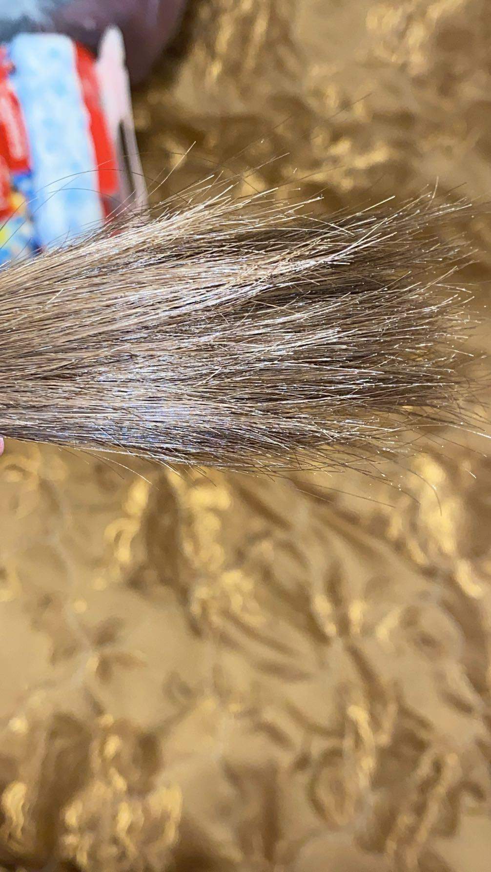 Weisse Punkte In Den Haaren