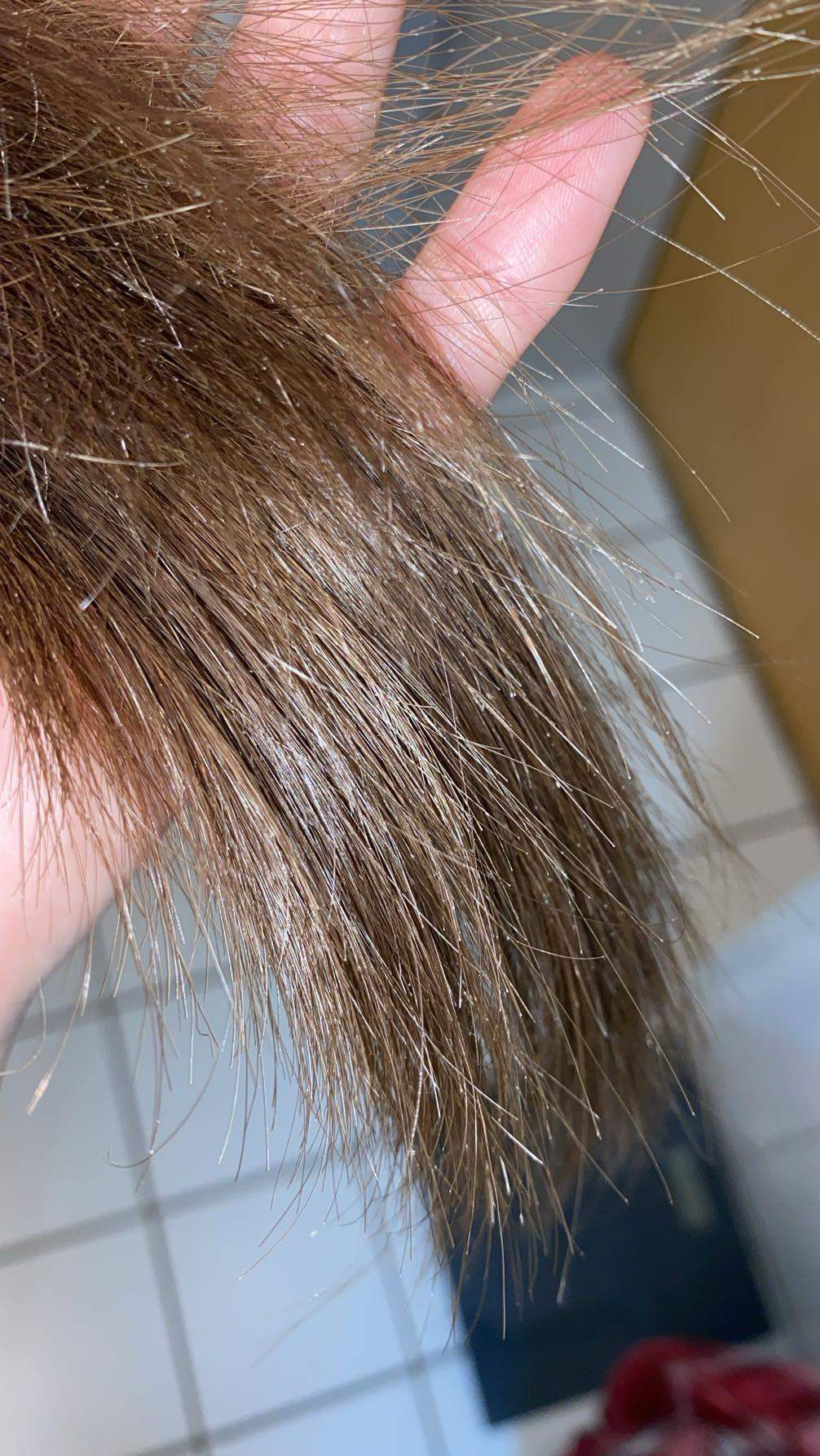 Weisse Punkte In Den Haaren