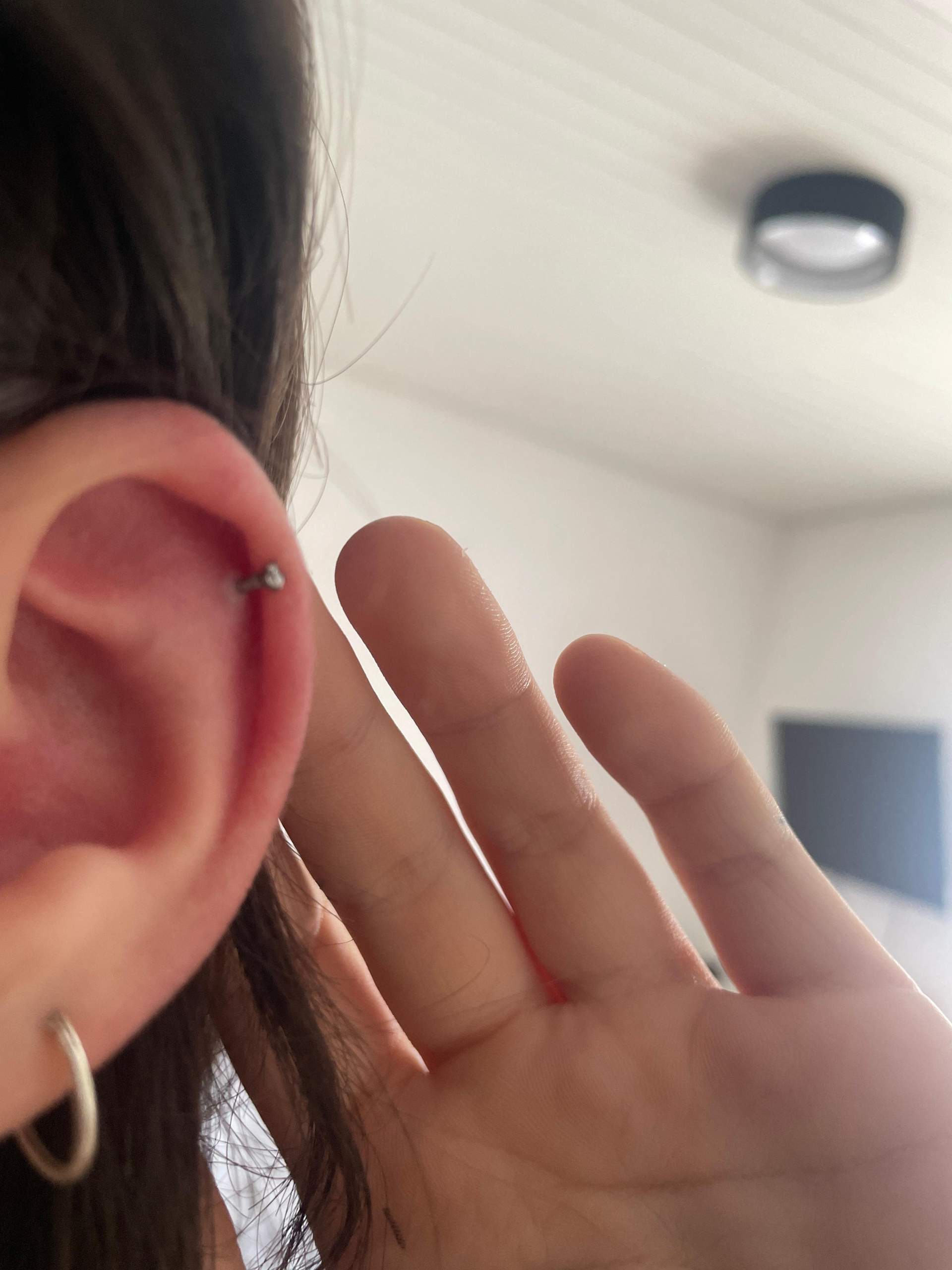 Weißer Ring um Helix? (Piercing, Ohr, Ohrpiercing)