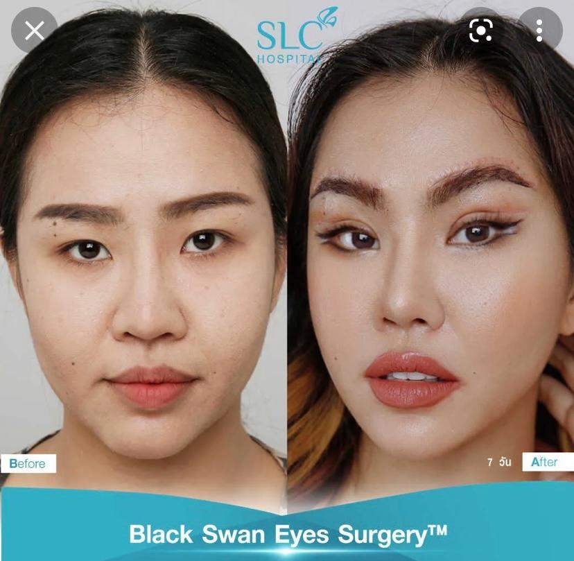 Welche Augenform findet ihr schöner? (Mädchen, Umfrage, Augen)