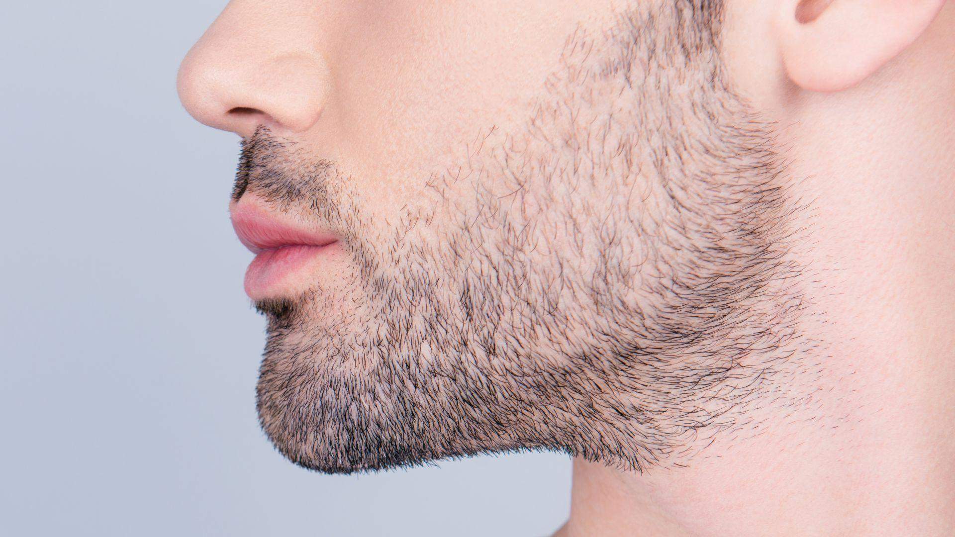 Welcher Bartstyle passt zu mir? (Bild)? (Liebe, Sex, Männer)