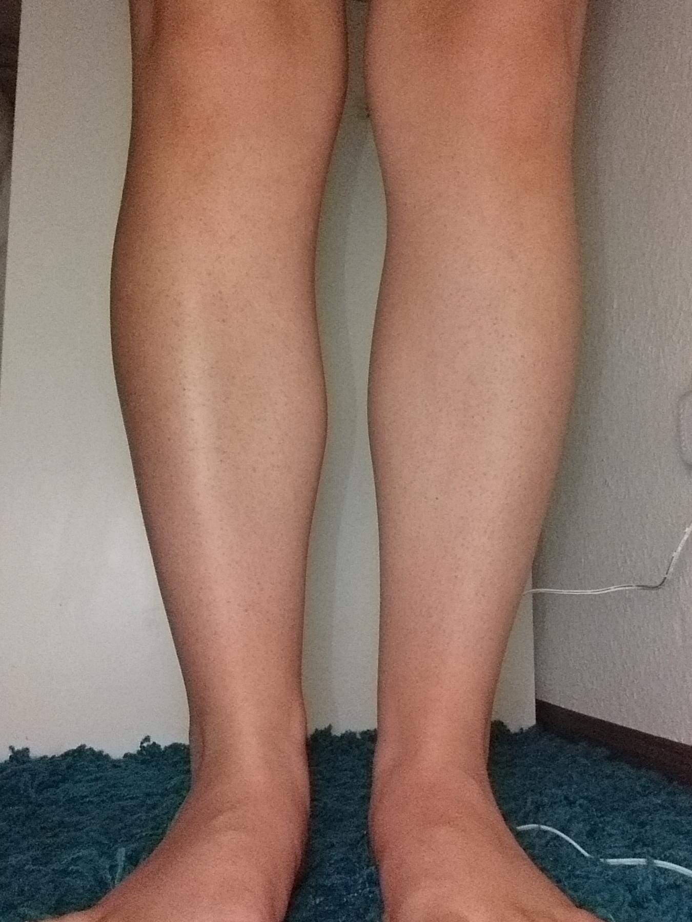 Wie findet ihr diese Waden? (Sport, Sport und Fitness)