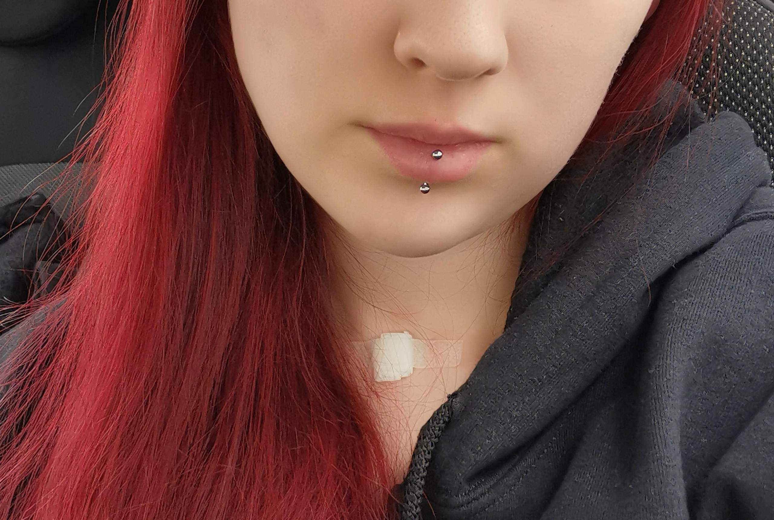 Wie findet ihr mein Eskimo Piercing, steht mir das? (Gesundheit und ...