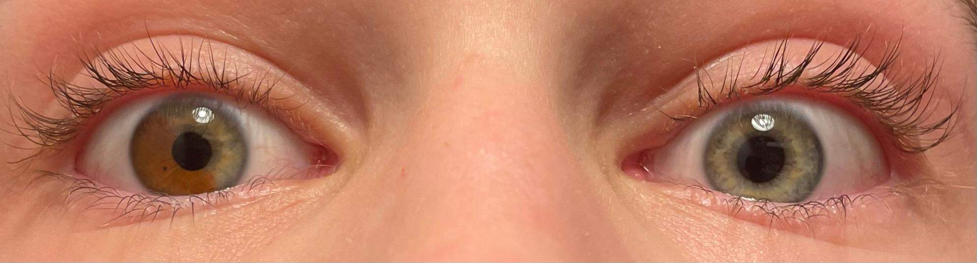 Wie findet ihr meine Augenfarben? (Augen, Allgemeinwissen, Augenfarbe)