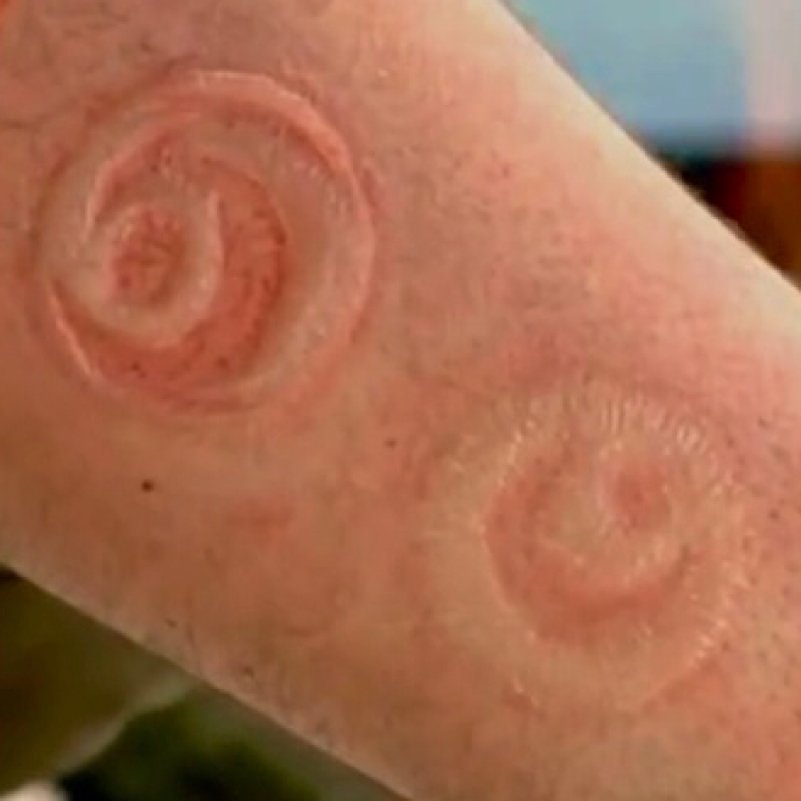 Wie narben machen!?!