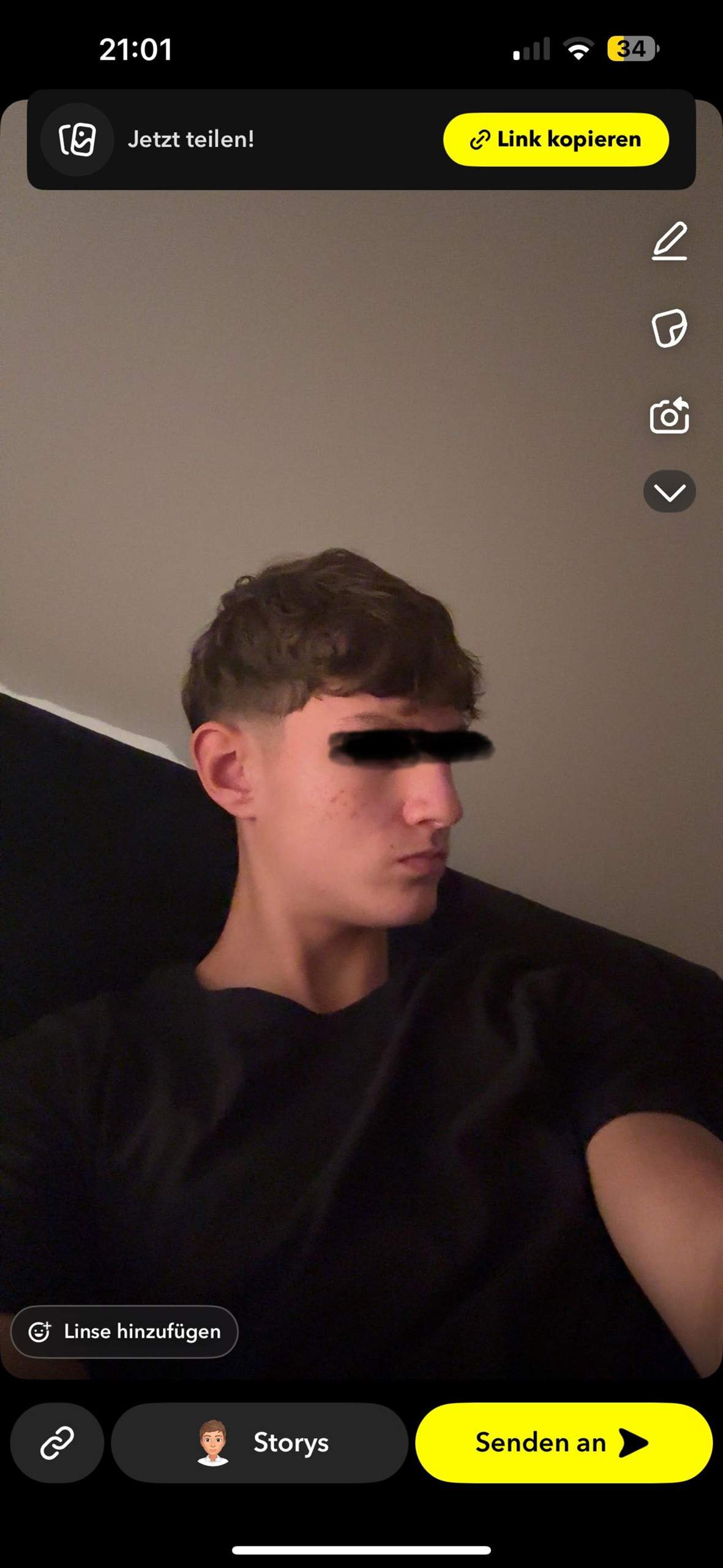 Wie schlimm ist meine Akne 😳😳? (Menschen, Haut)