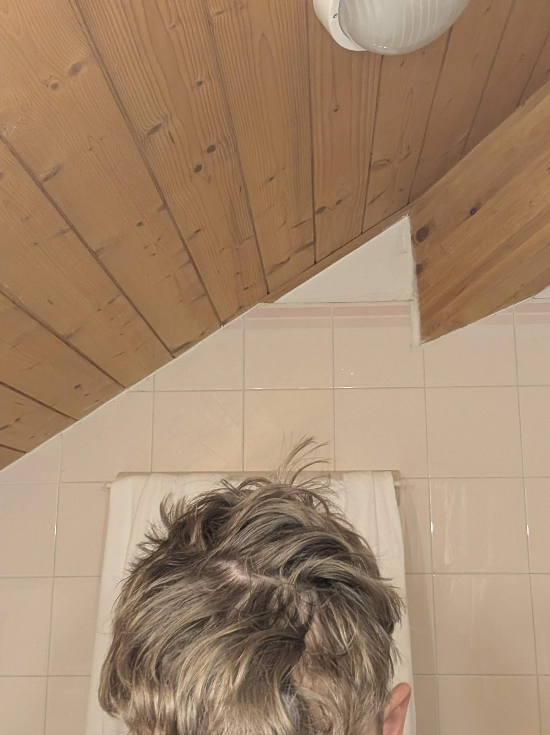 Wie schlimm steht es um meinen Haarausfall und was tun? (Aussehen ...