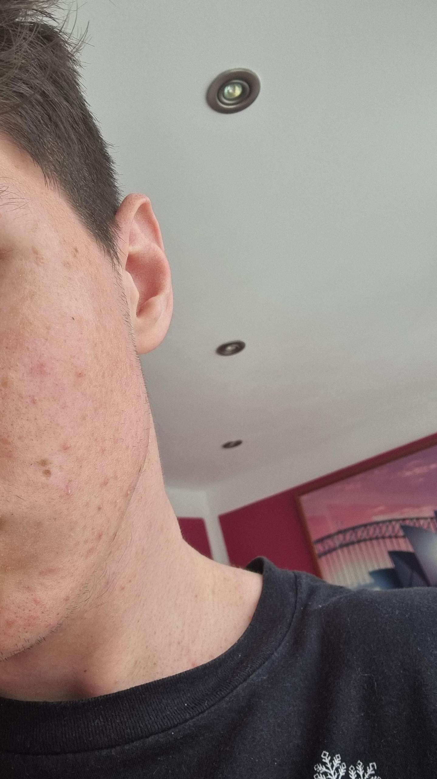 Wieso sieht meine haut so aus? (Körper, Pickel, Gesicht)