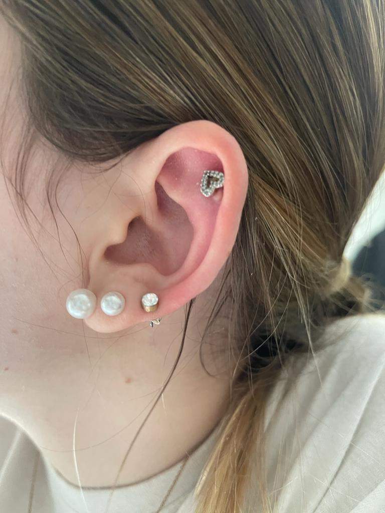 Wildfleisch am helix? (Piercing, Entzündung, Ohr)