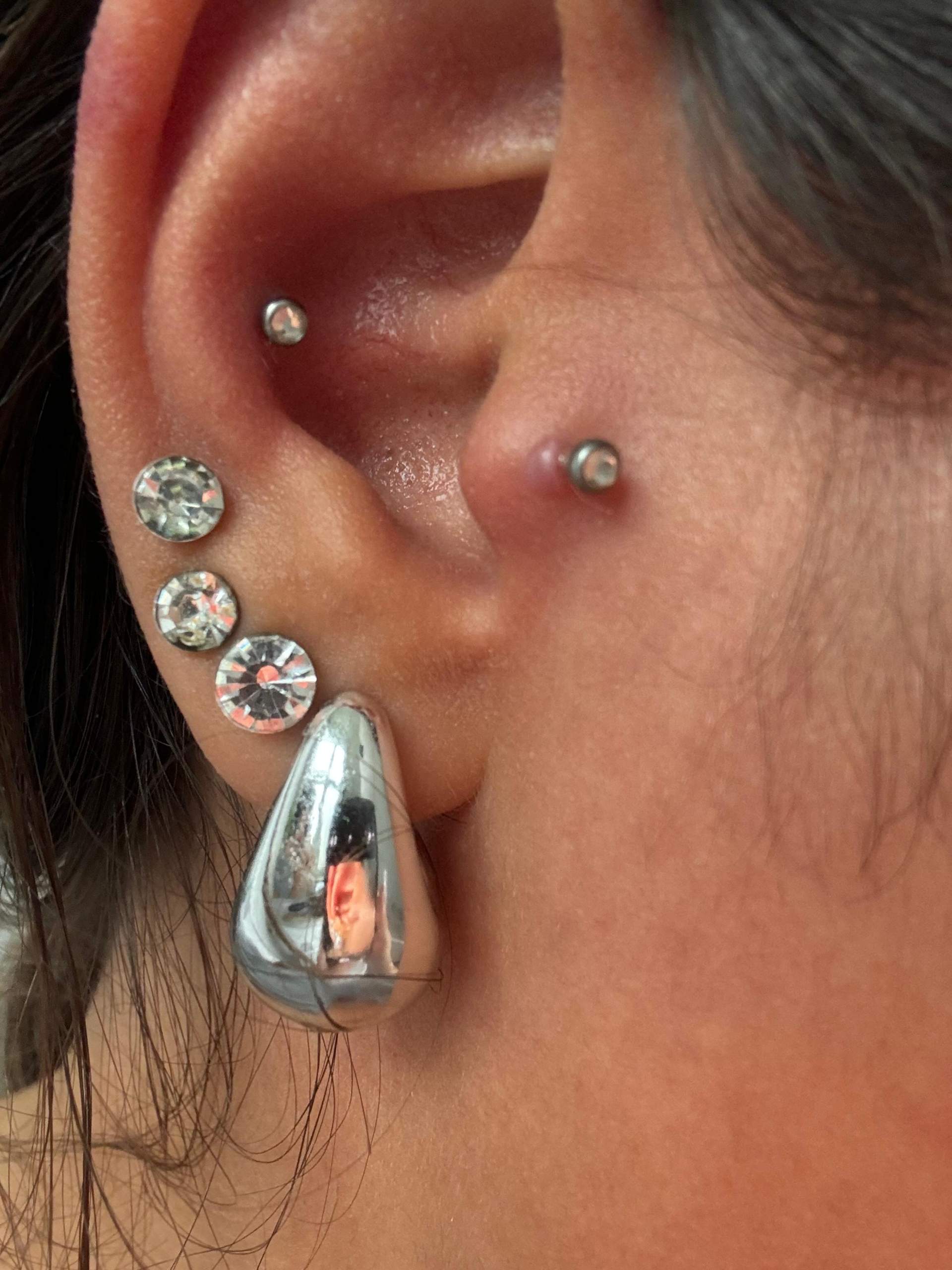 Wildfleisch am Tragus? (Piercing, Bauchnabelpiercing, Piercingpflege)