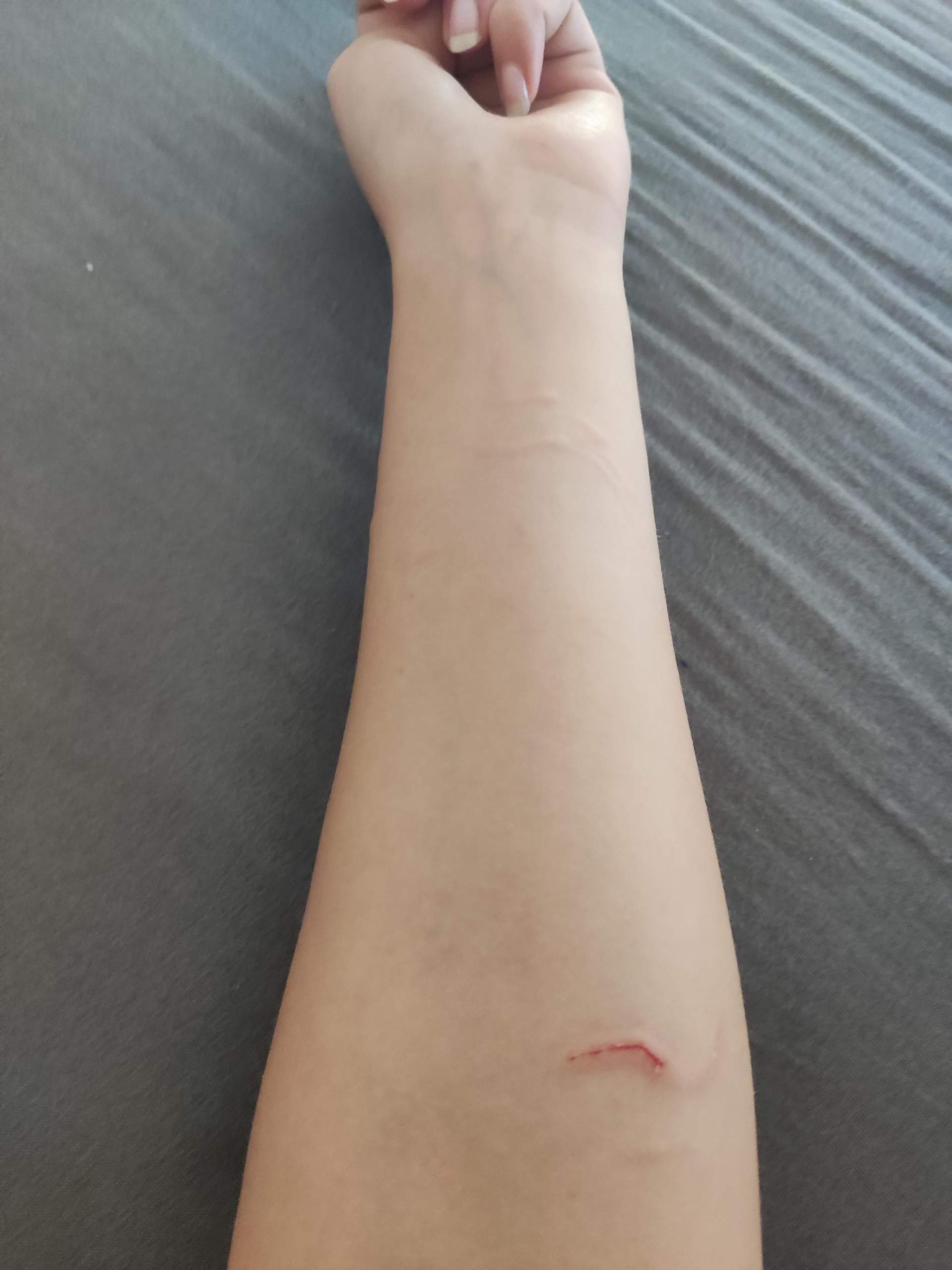 Wundspray bei Katzenbiss? (Gesundheit und Medizin, Katze)