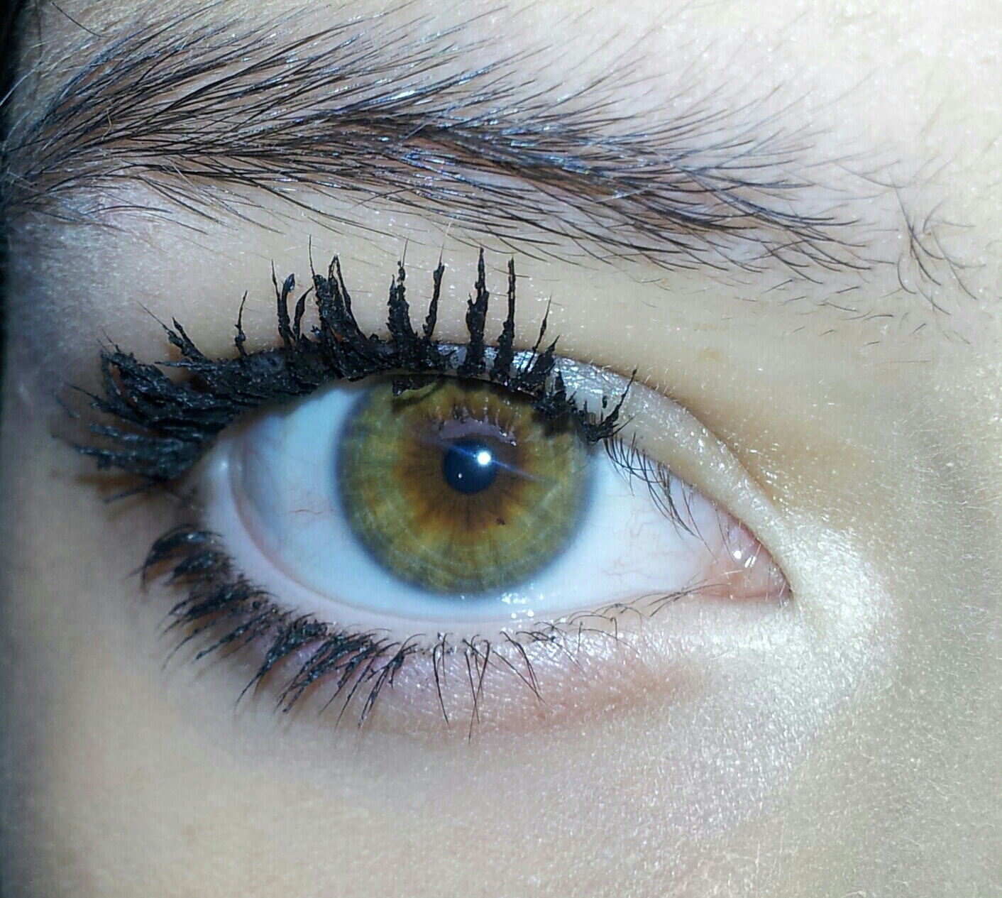 Zentrale Iris-Heterochromie? (Menschen, Biologie, Augen)