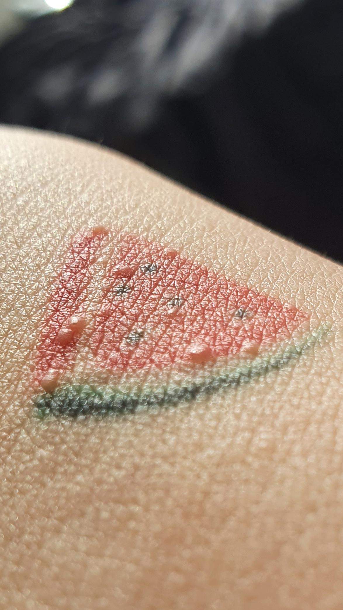 Zwei Jahre altes Tattoo bekommt Bläschen? (Pflege, Tattoopflege ...